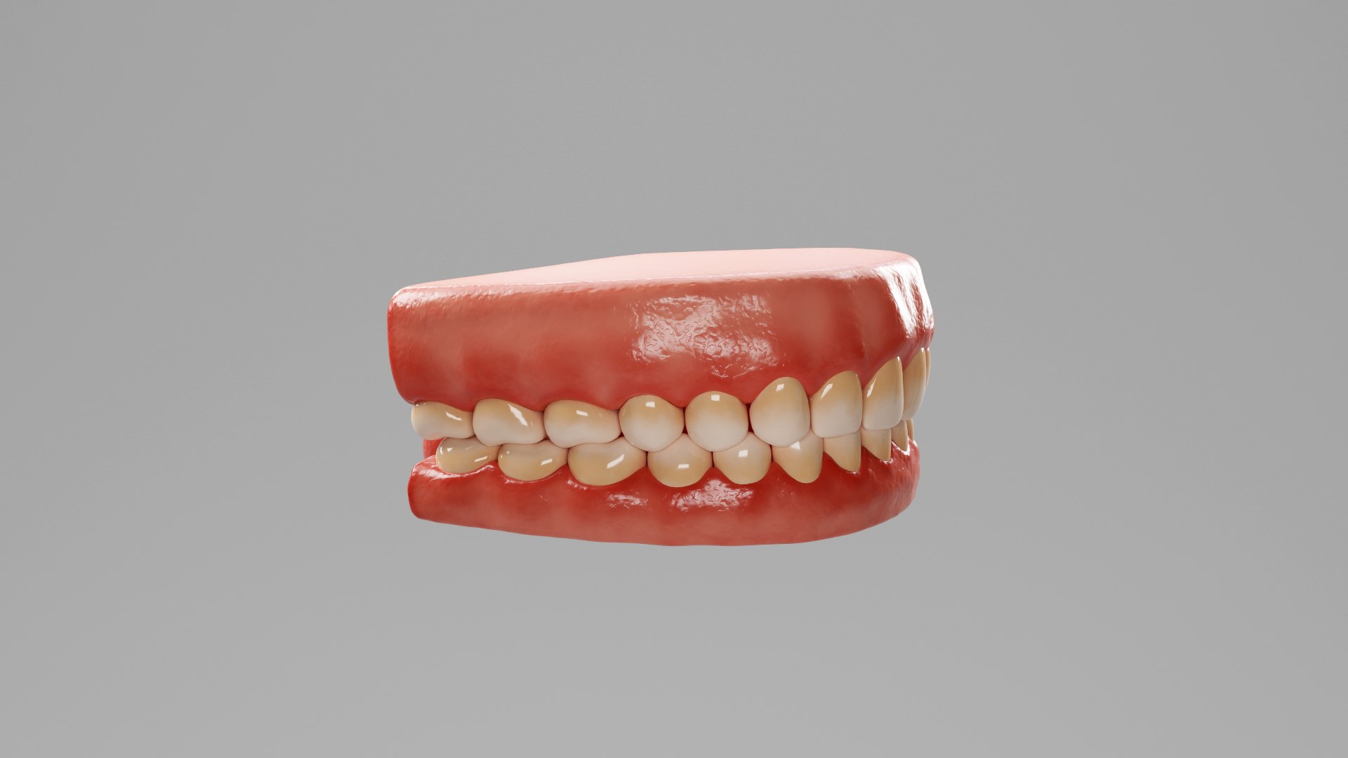 Dental Prosthesis Modelling 3D Model - TurboSquid 1656597