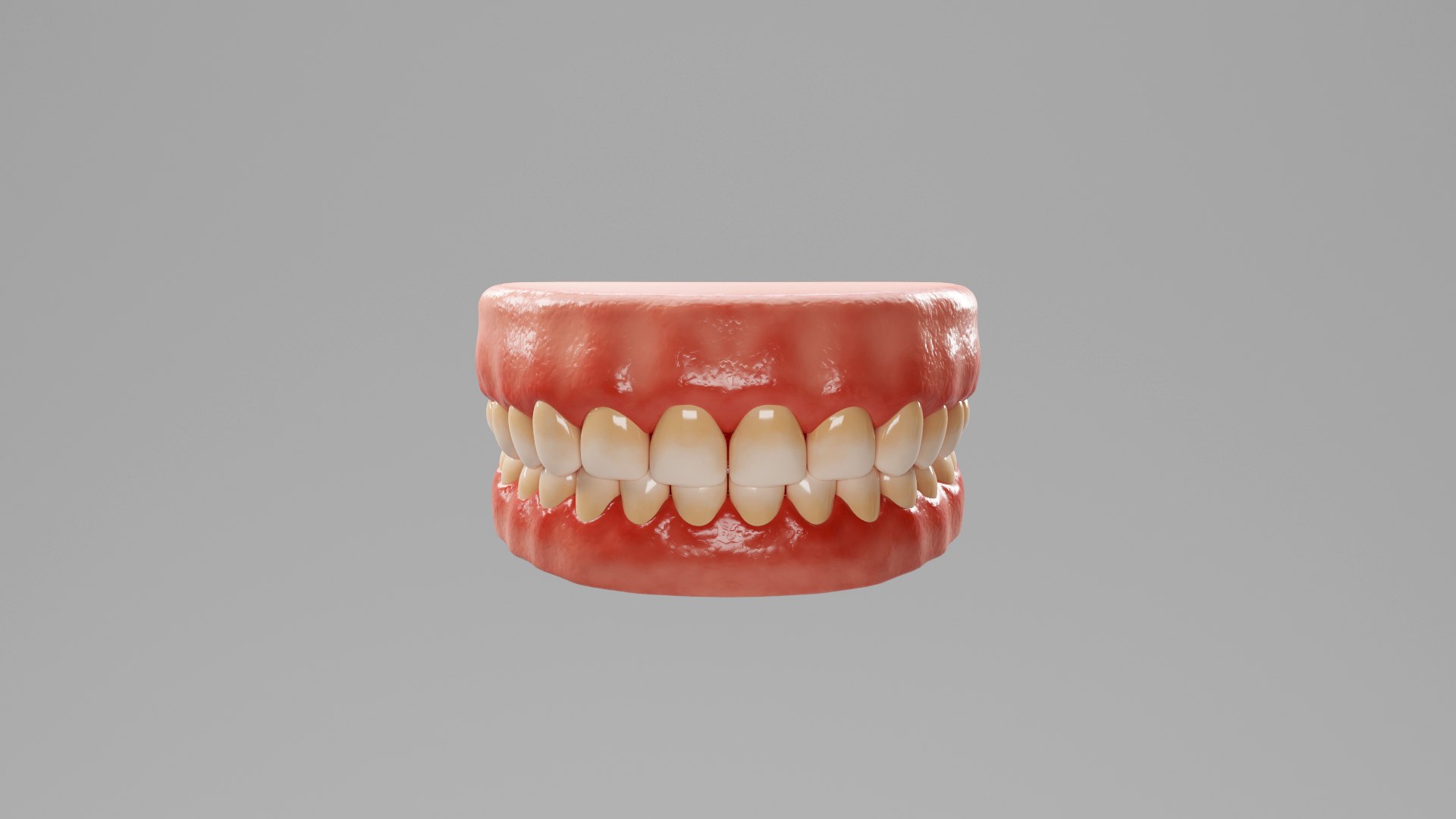 Dental Prosthesis Modelling 3D Model - TurboSquid 1656597