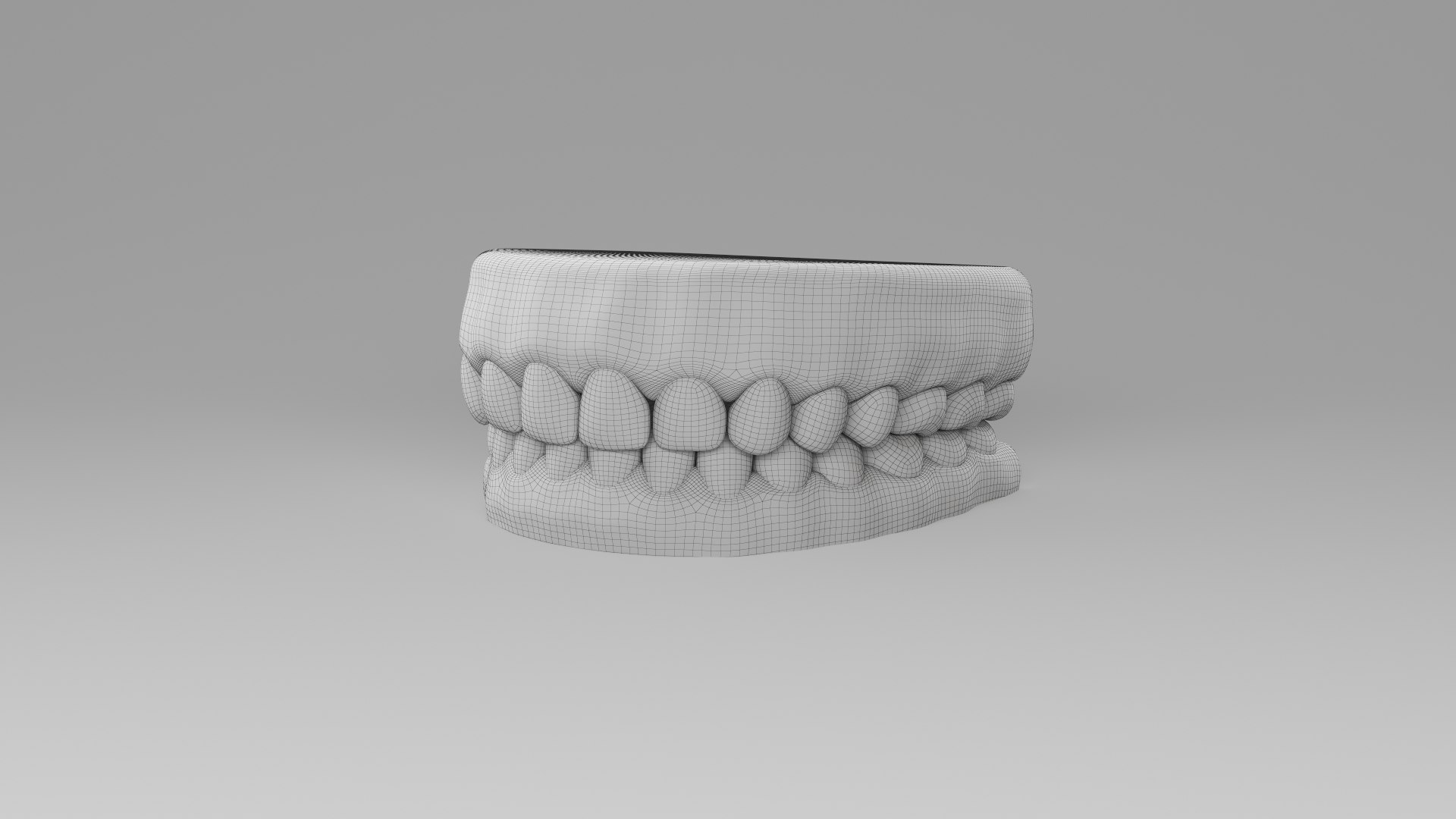 Dental Prosthesis Modelling 3D Model - TurboSquid 1656597