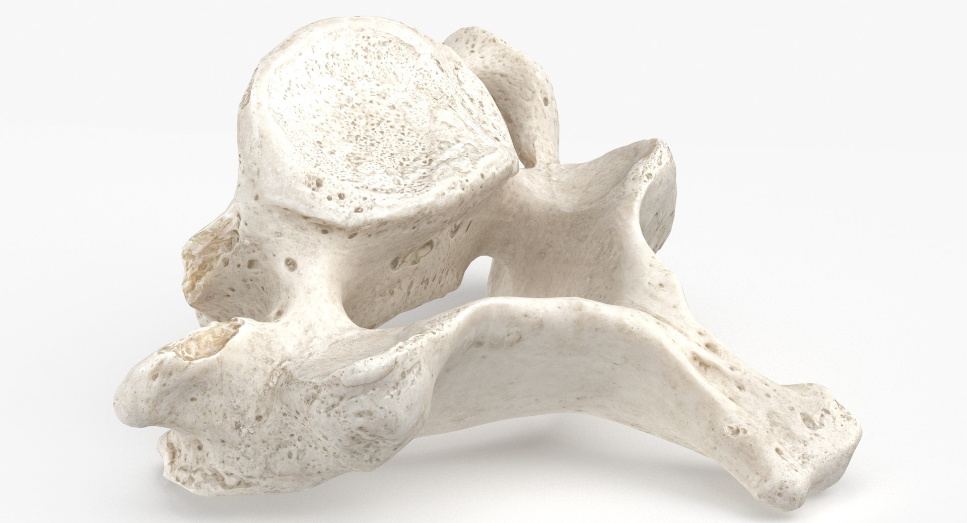 Cervical Vertebrae C7 White 3D Model - TurboSquid 1709343
