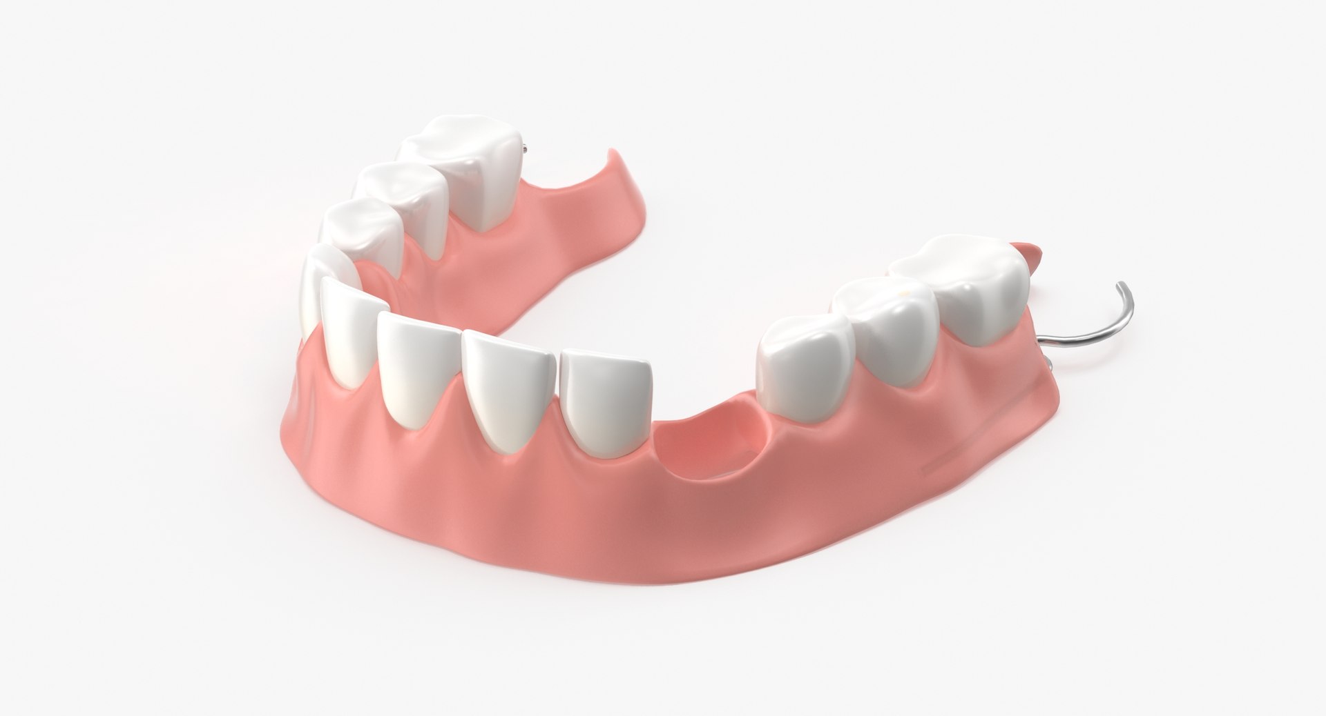3D Jaw Prosthesis - TurboSquid 2281947
