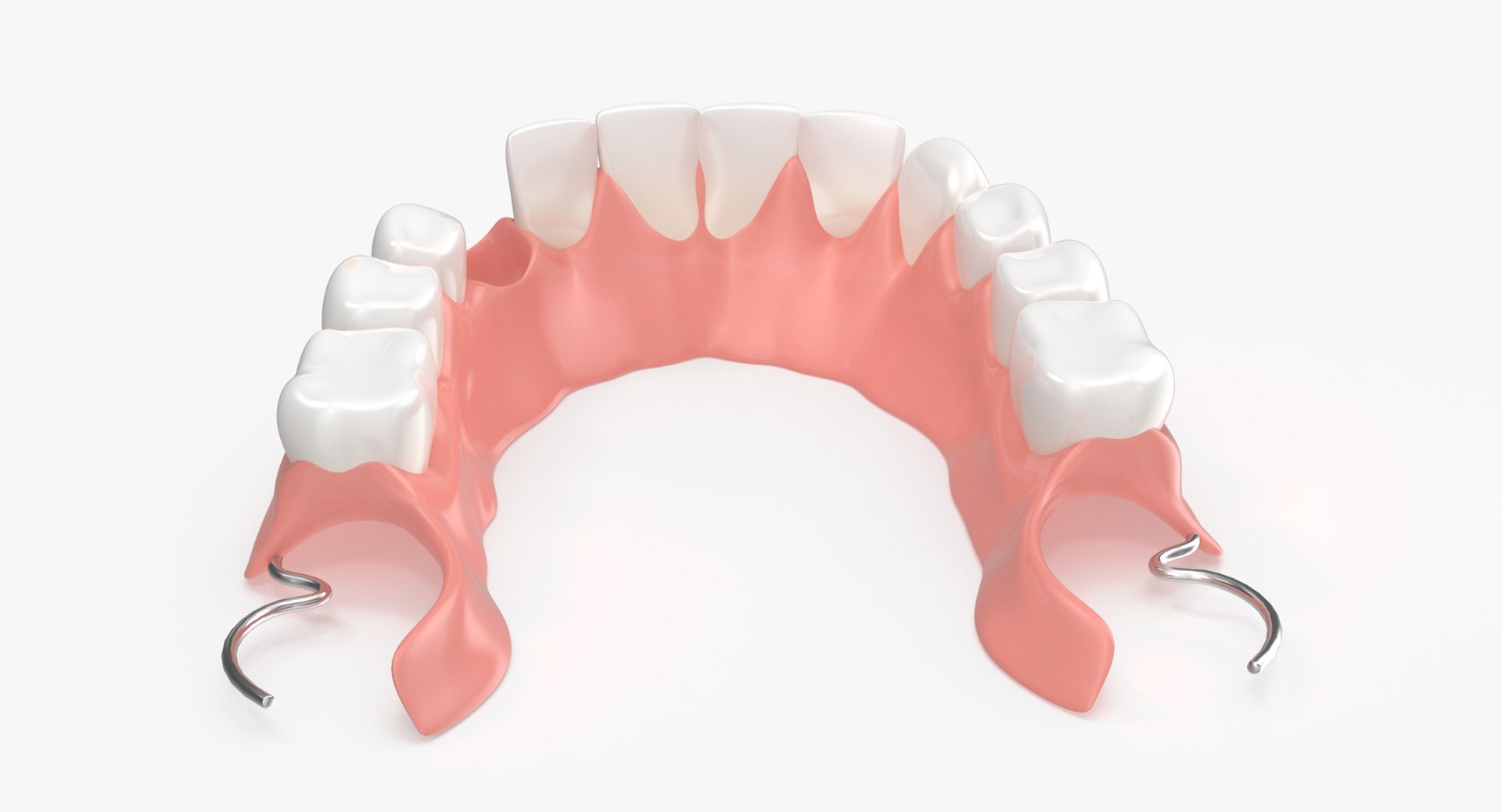 3D Jaw Prosthesis - TurboSquid 2281947