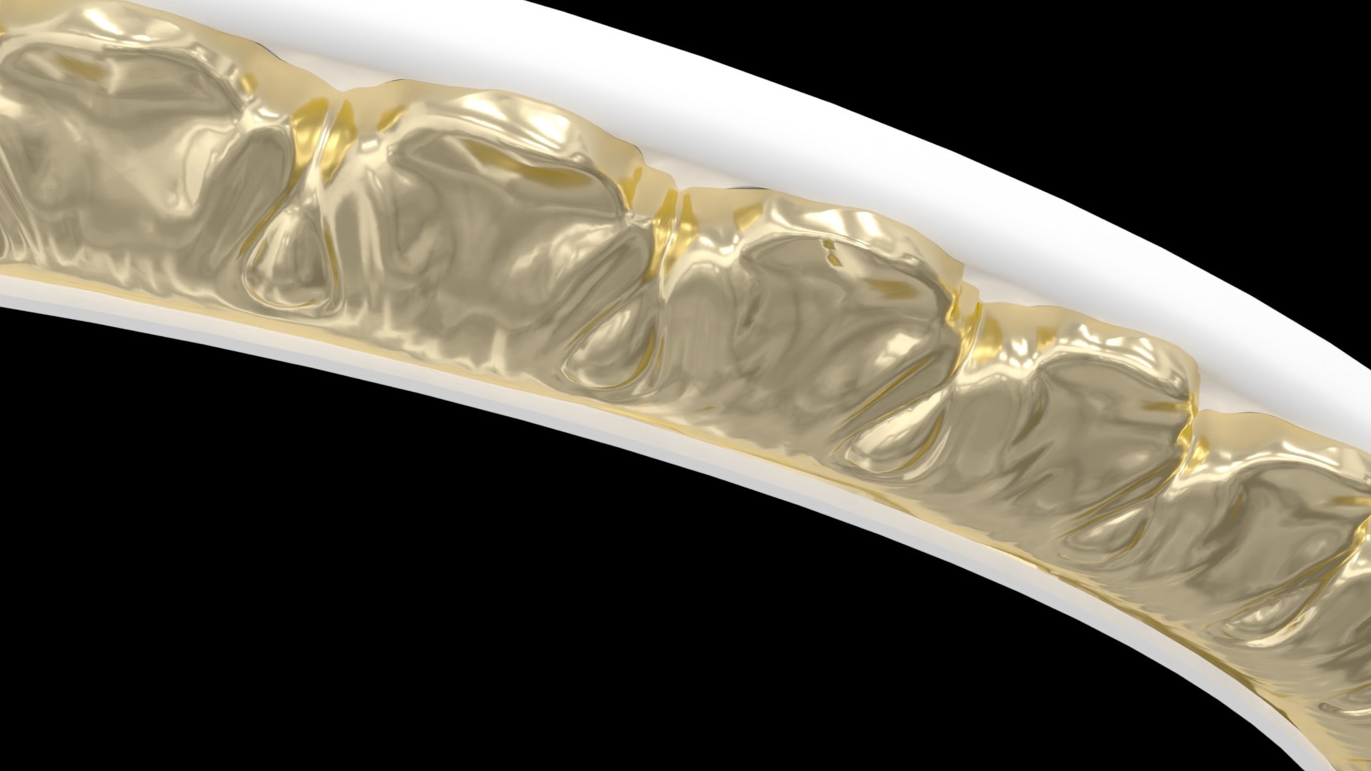 3D Ceiling Sockets Gypsum Plaster DR255 - TurboSquid 2034581