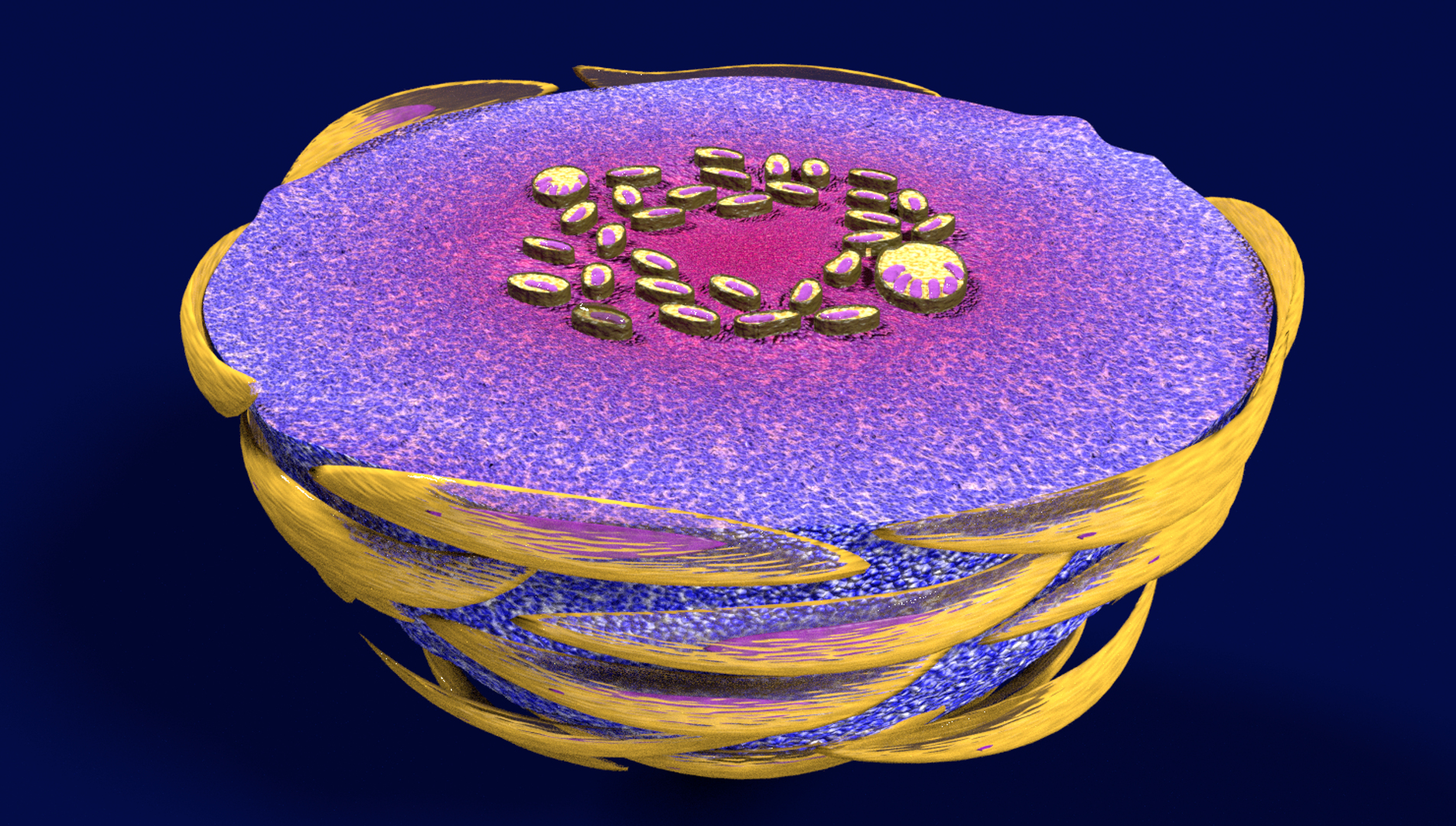 3D Tubercular Caseating Model - TurboSquid 1592510