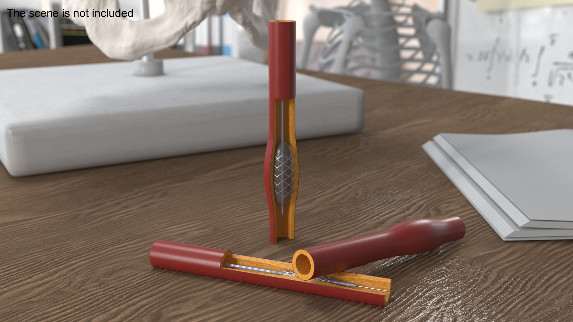 Plastic Models Of Stents With Artery 3D Model - TurboSquid 2239722