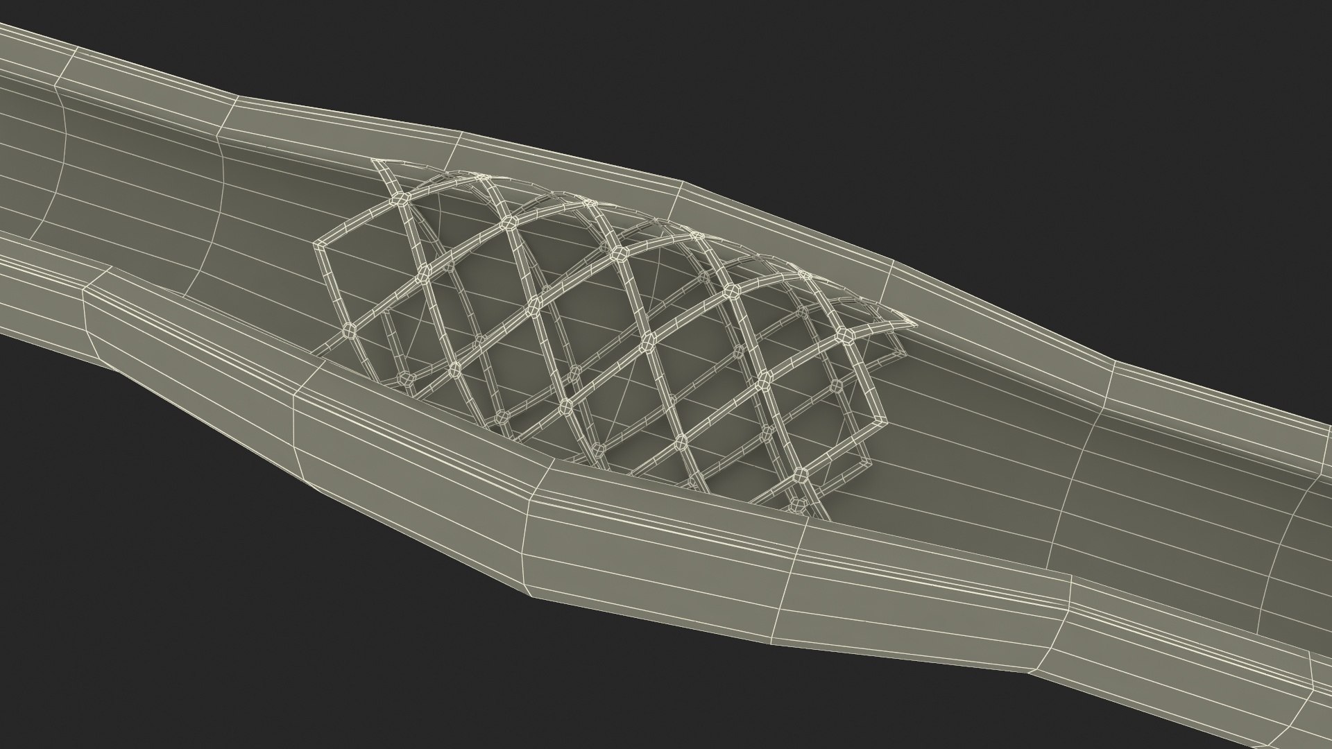 Plastic Models Of Stents With Artery 3D Model - TurboSquid 2239722