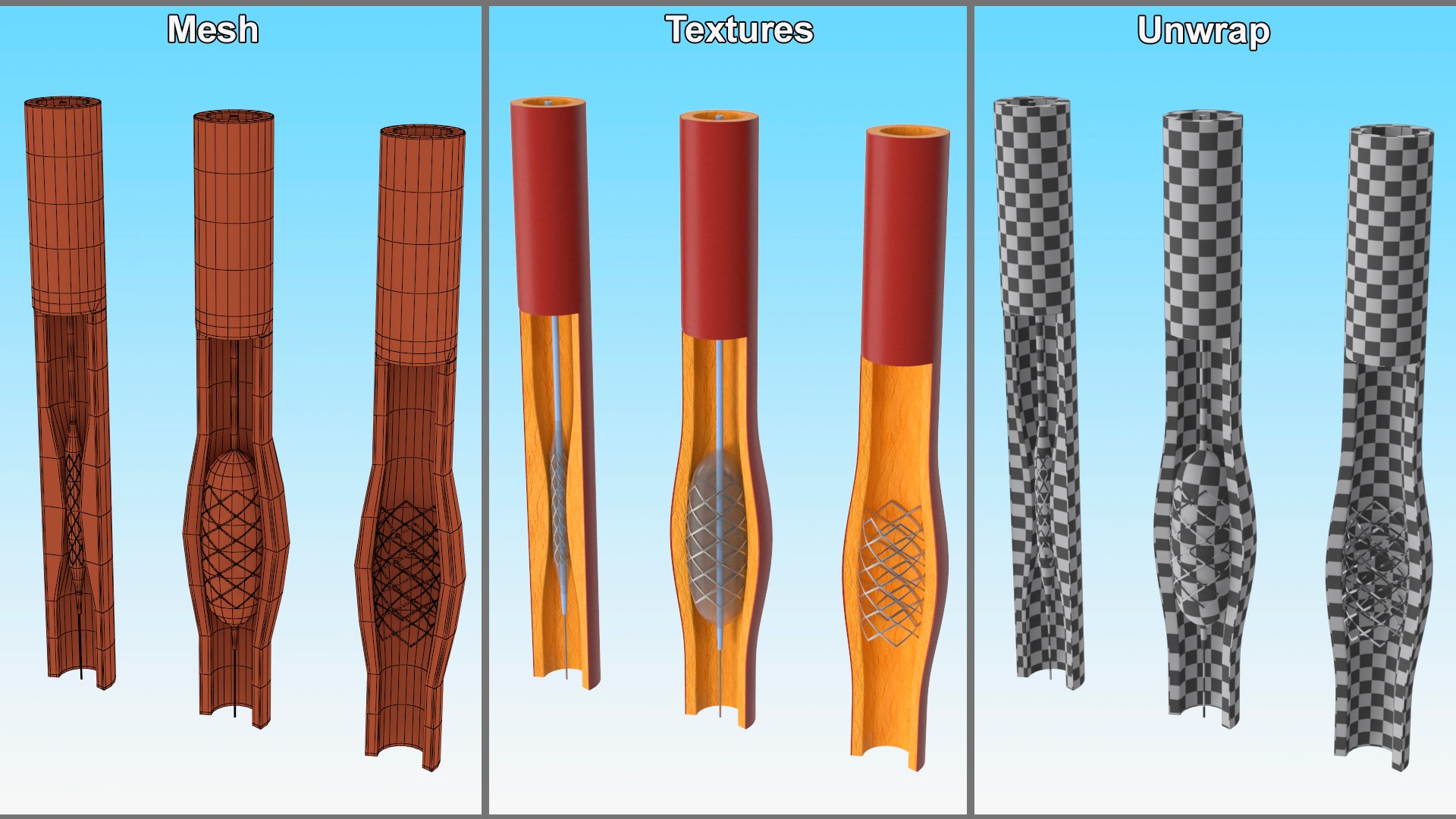 Plastic Models Of Stents With Artery 3D Model - TurboSquid 2239722