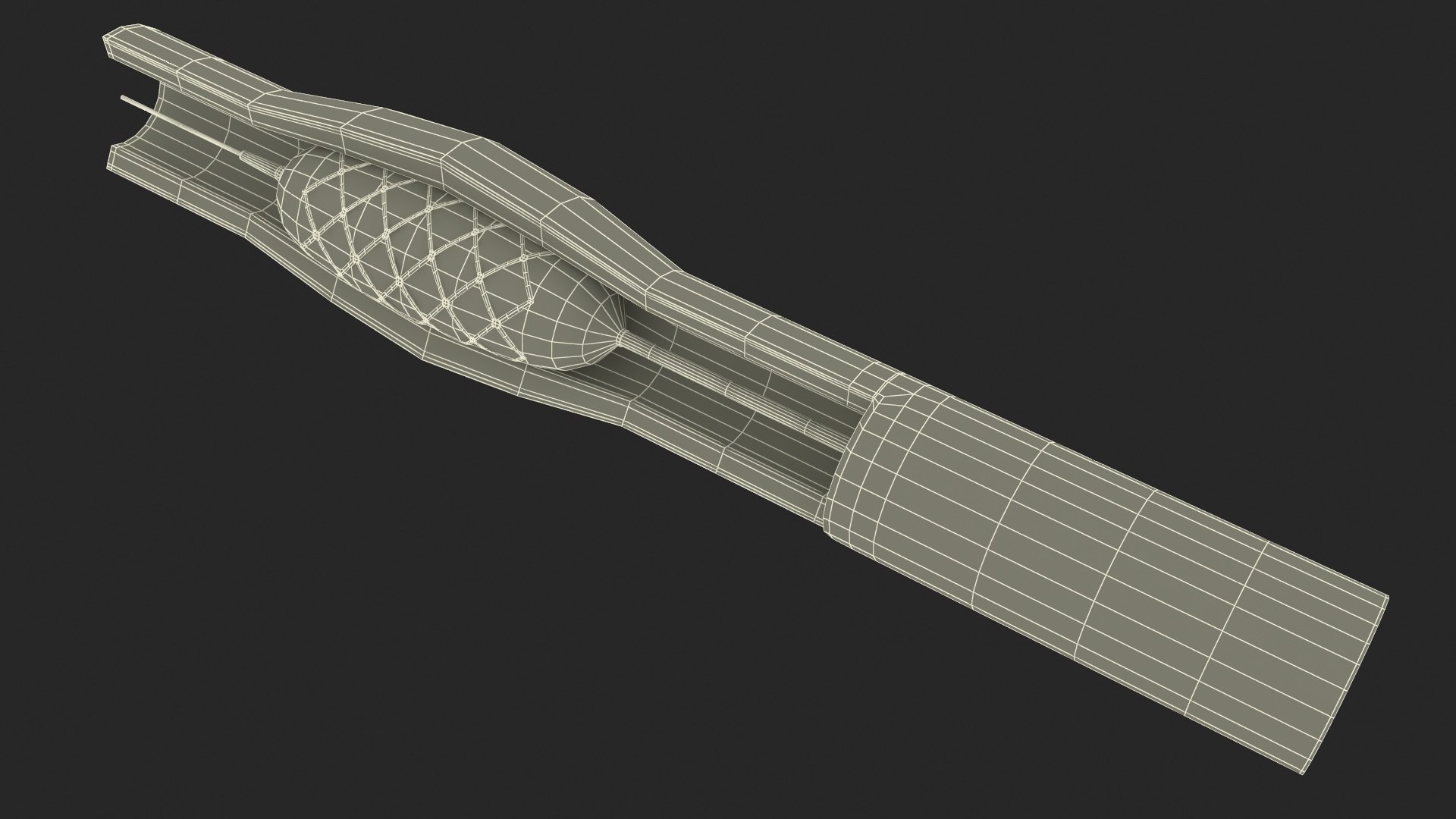 Plastic Models Of Stents With Artery 3D Model - TurboSquid 2239722