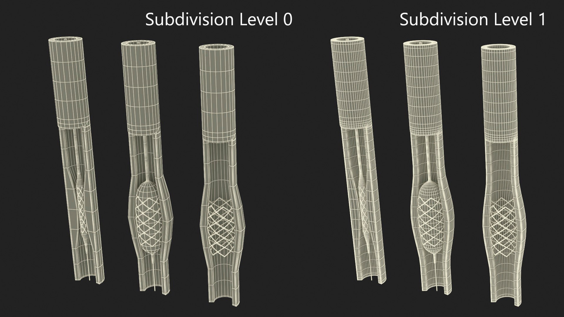 Plastic Models Of Stents With Artery 3D Model - TurboSquid 2239722
