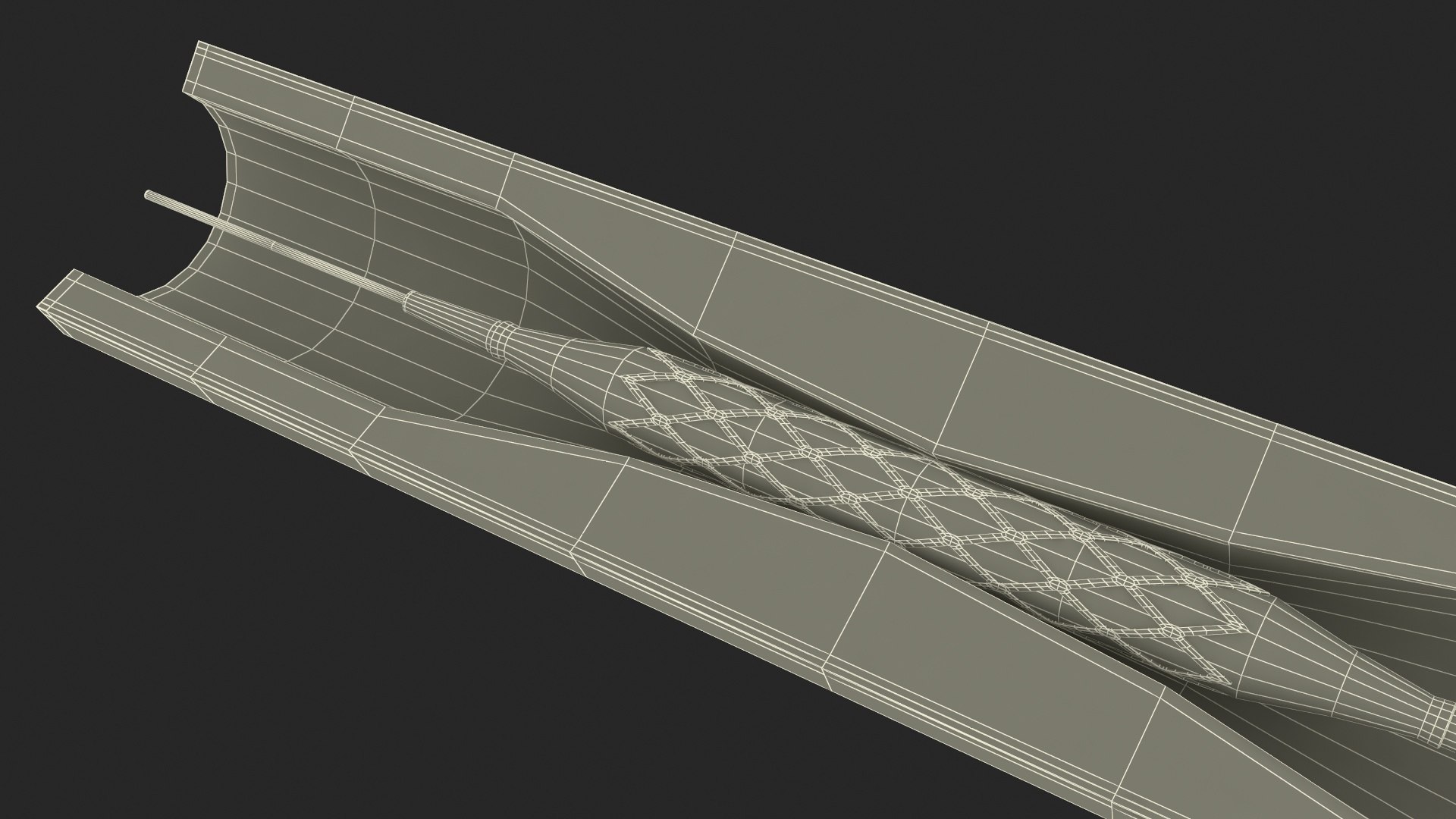Plastic Models Of Stents With Artery 3D Model - TurboSquid 2239722
