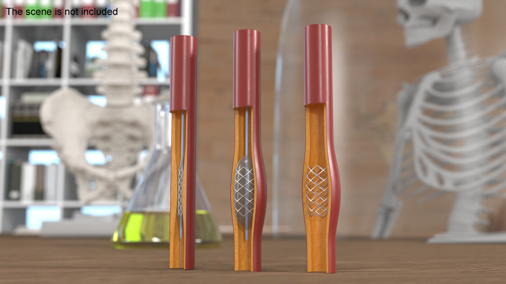 Plastic Models Of Stents With Artery 3D Model - TurboSquid 2239722