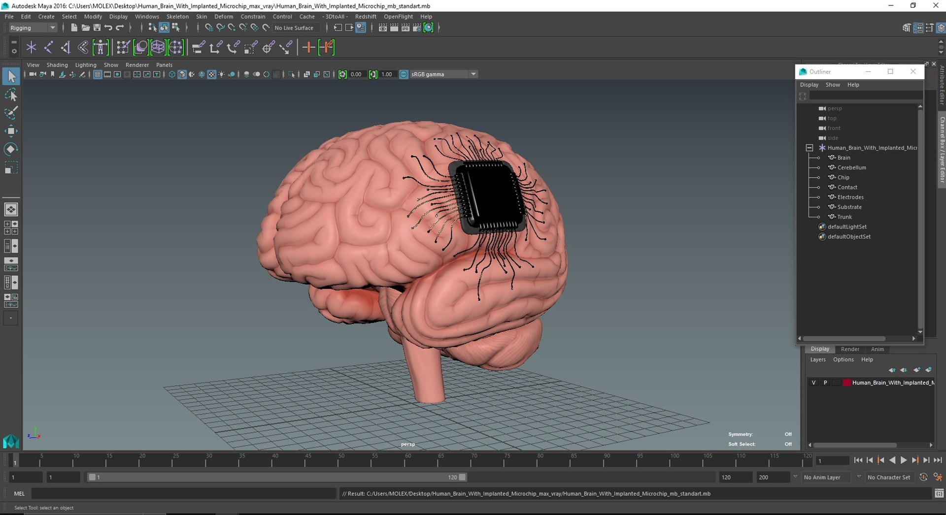 Human Brain With Implanted Microchip For 3D Print 3D - TurboSquid 2270850