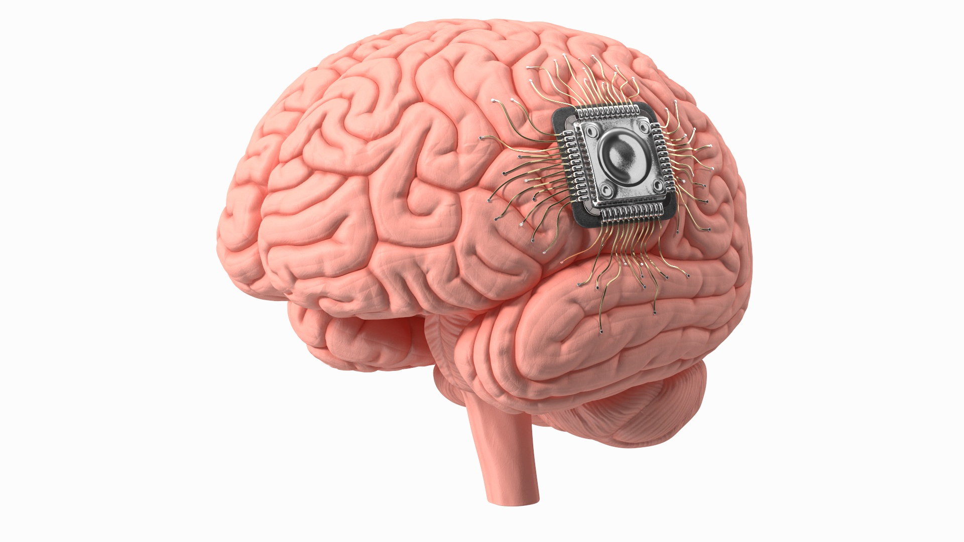 Human Brain With Implanted Microchip For 3D Print 3D - TurboSquid 2270850