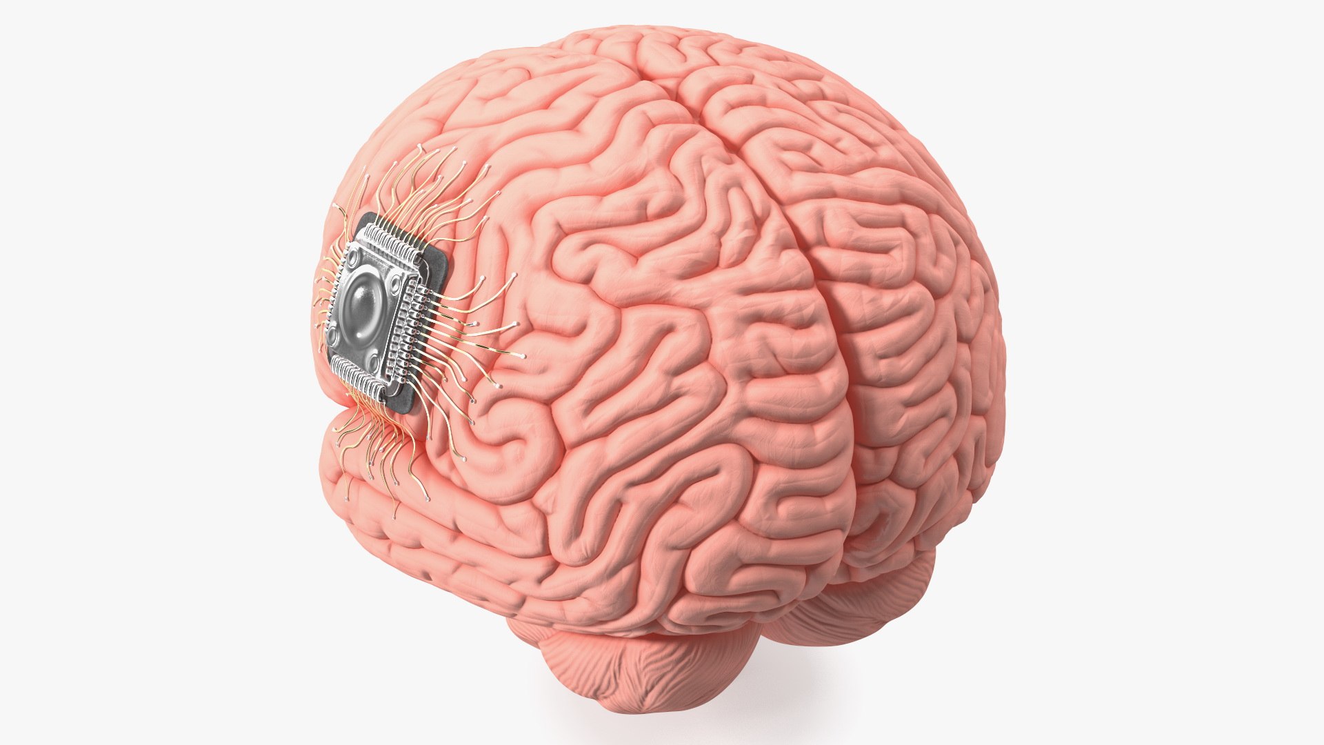 Human Brain With Implanted Microchip For 3D Print 3D - TurboSquid 2270850