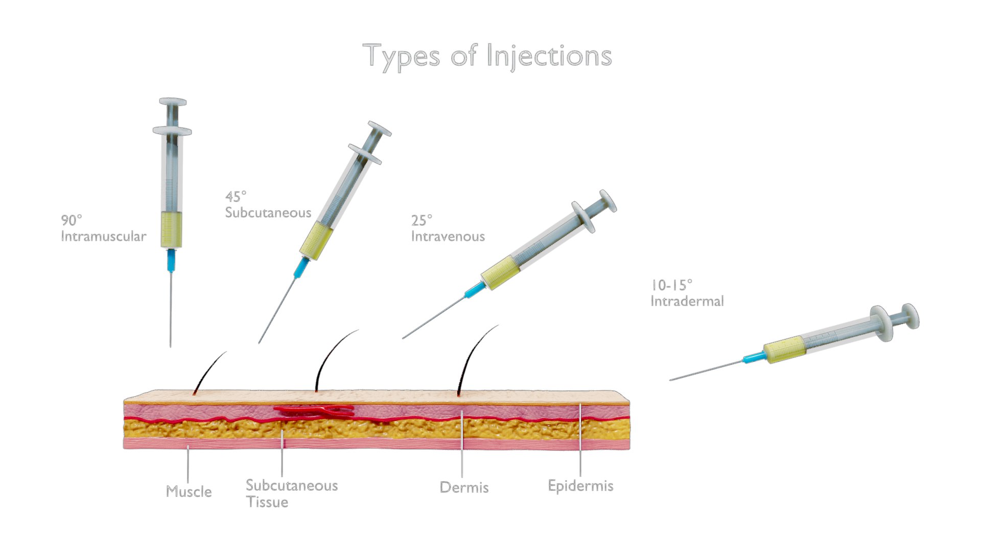 3D Model Types Of Injections With Animation - TurboSquid 2508248