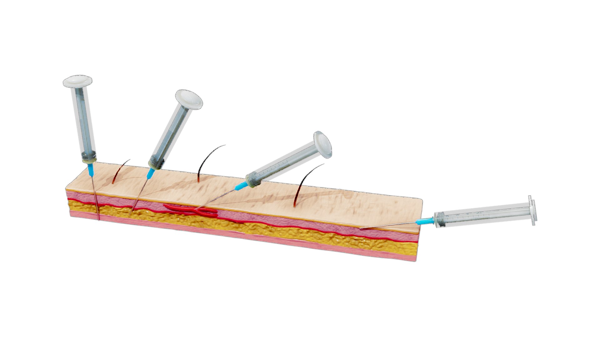 3D Model Types Of Injections With Animation - TurboSquid 2508248