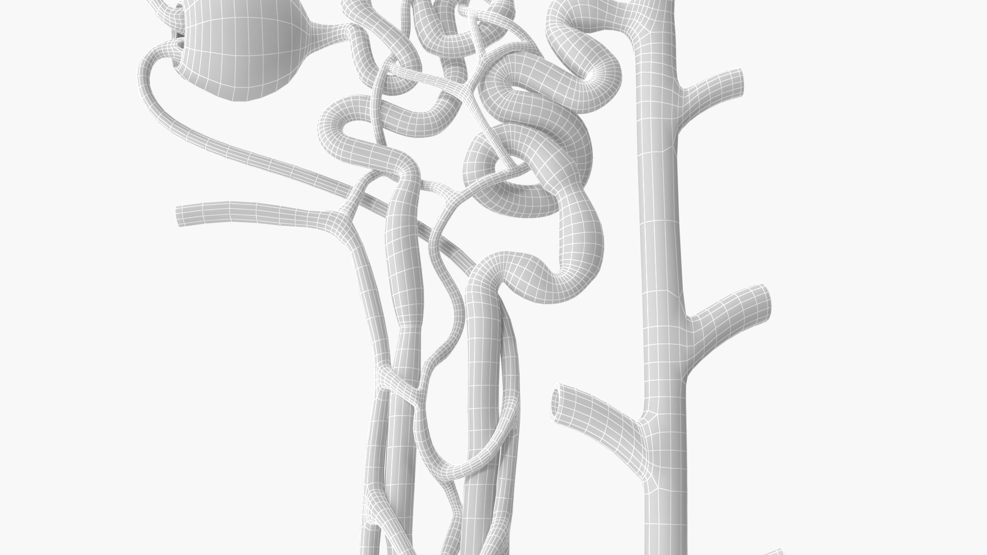 Kidney Nephron Unhealthy Damaged structure 3D model - TurboSquid 1737533