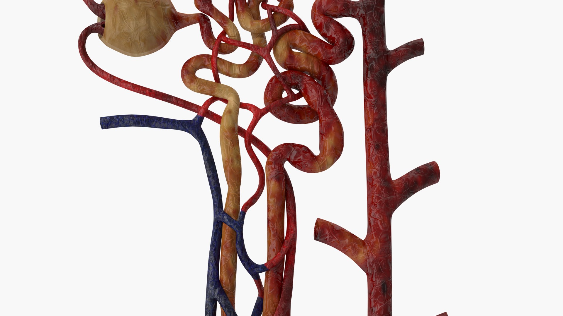 Kidney Nephron Unhealthy Damaged structure 3D model - TurboSquid 1737533
