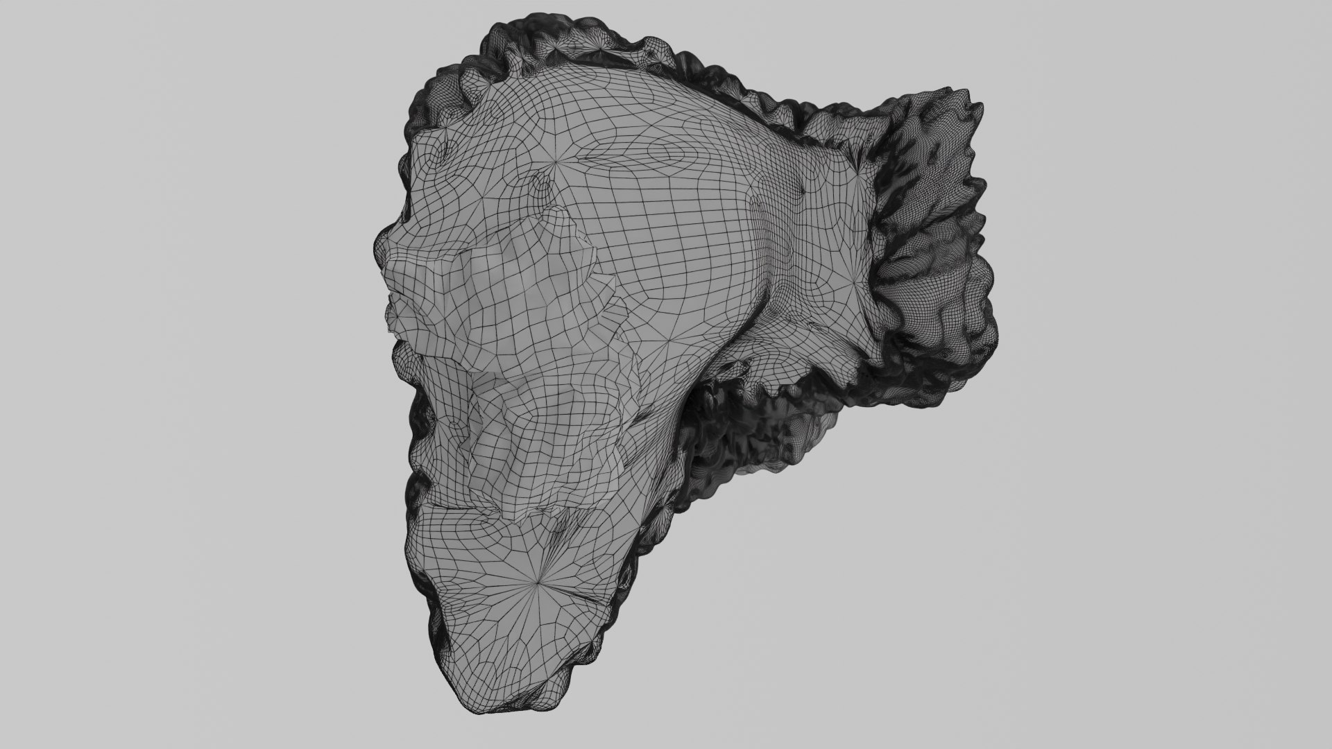 3D Liver Cancer HCC Vs Metastatic - TurboSquid 1981576