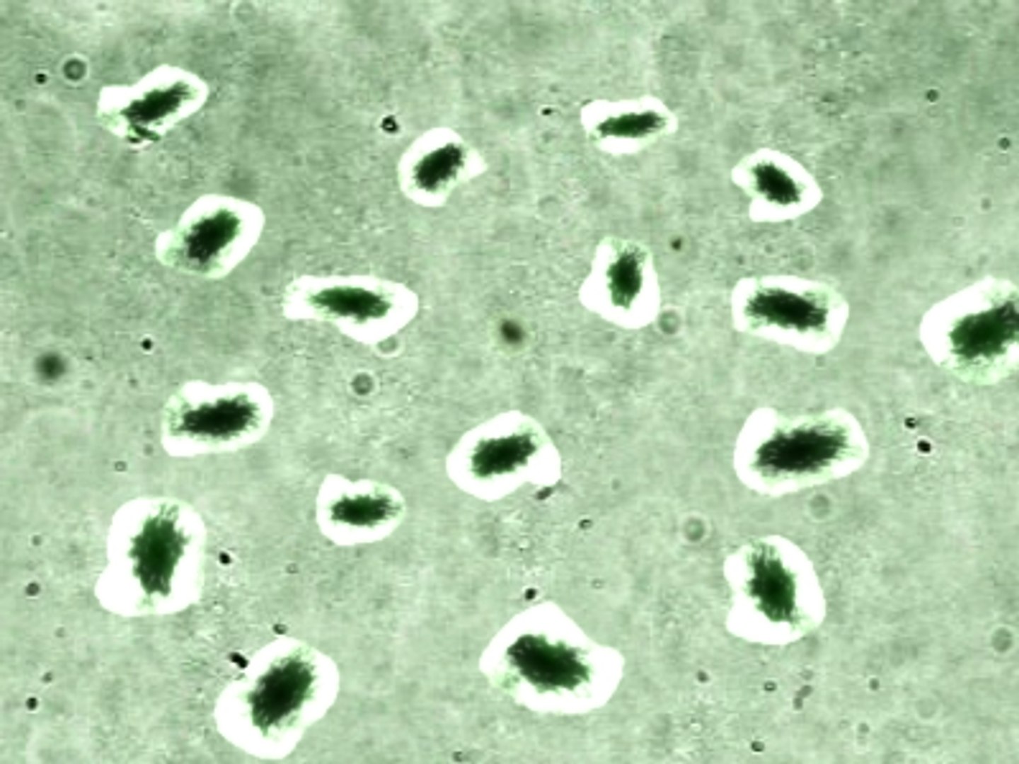 Max Realistic Amebas