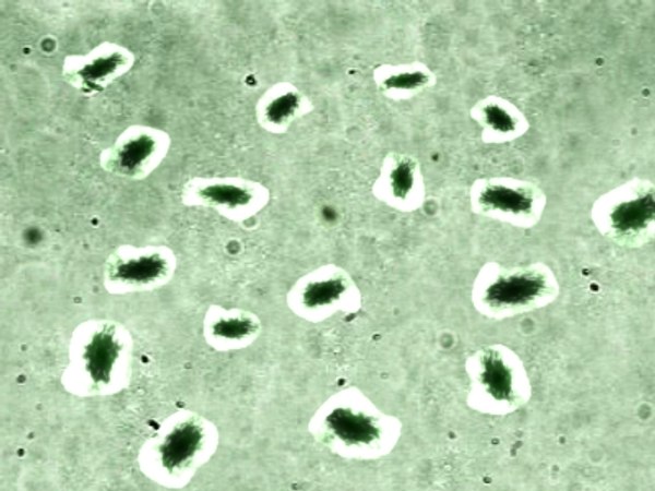 max realistic amebas