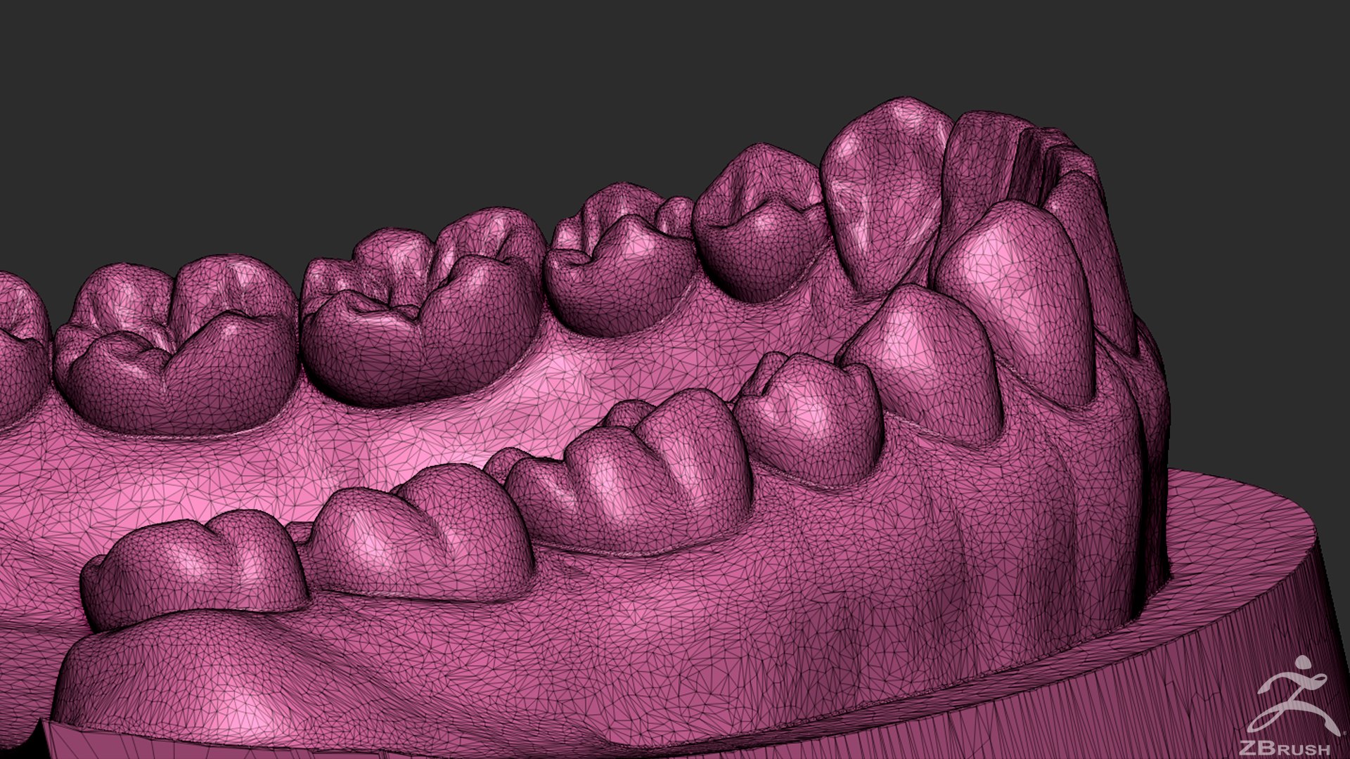 Maxillary and Mandibular dental 3D print model 3D - TurboSquid 1722311