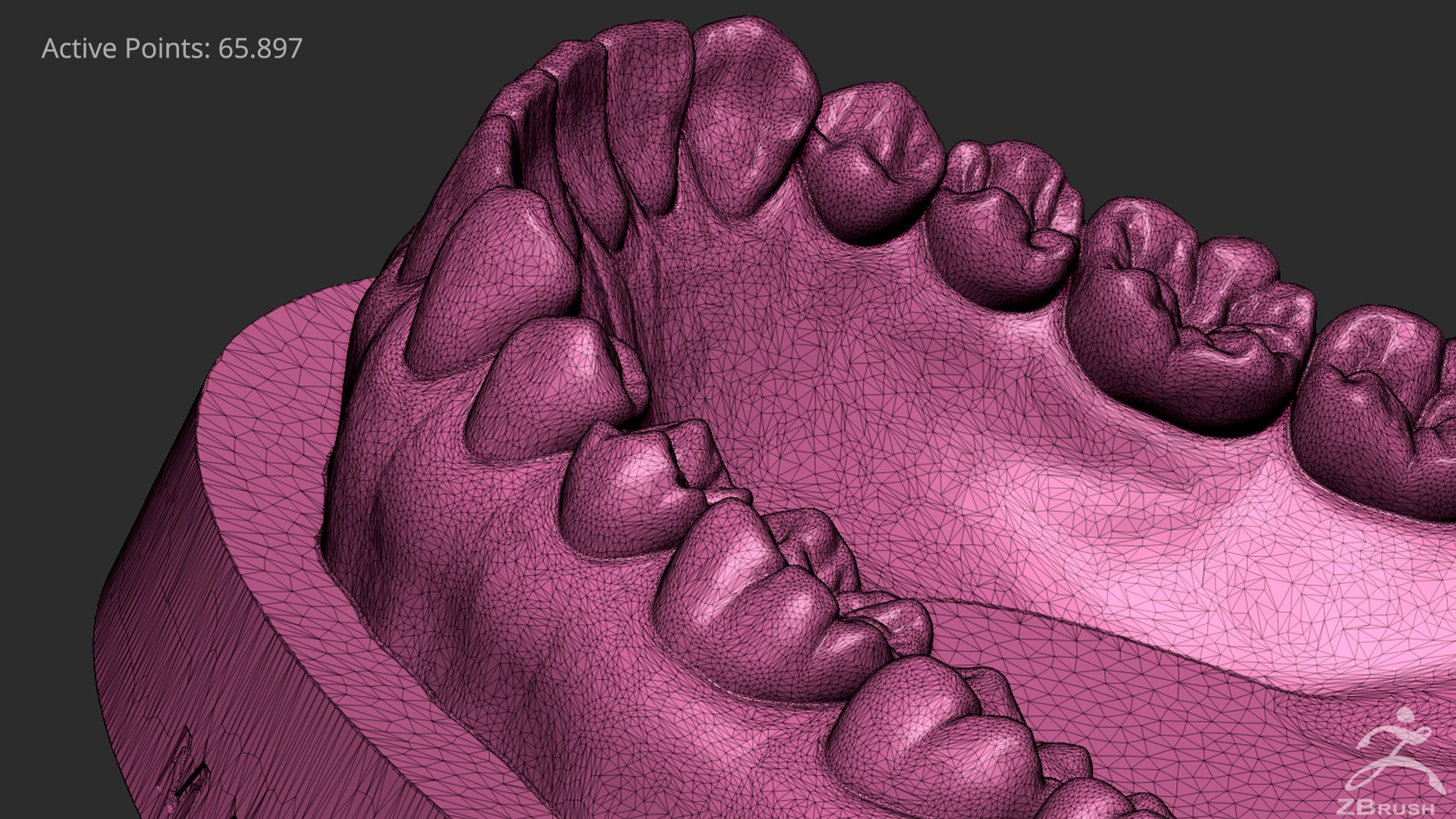 Maxillary and Mandibular dental 3D print model 3D - TurboSquid 1722311