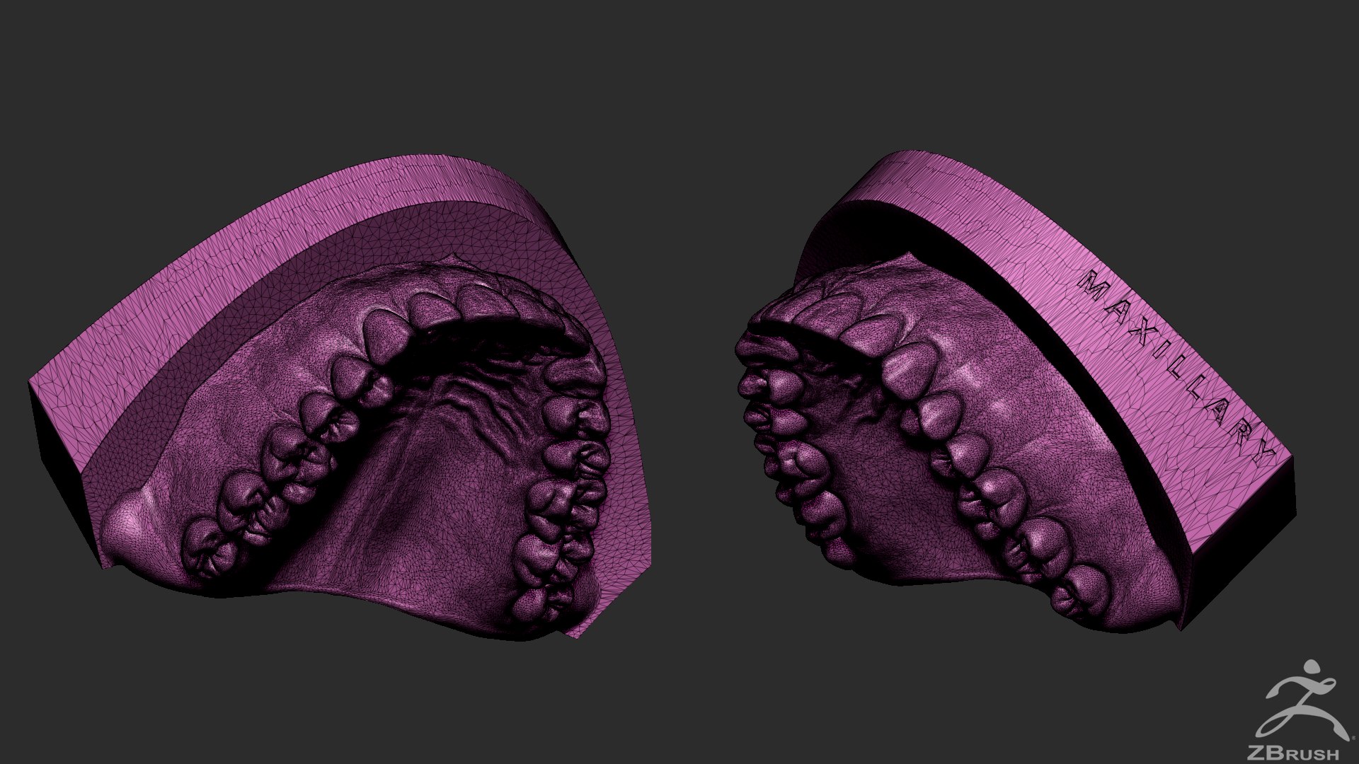 Maxillary and Mandibular dental 3D print model 3D - TurboSquid 1722311