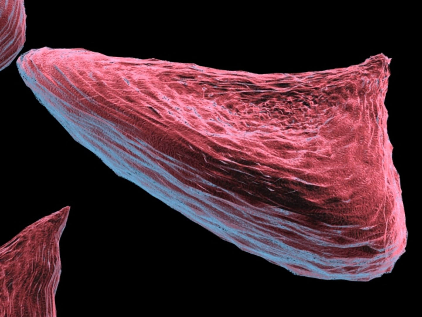 Blood Cells Sickle Anaemia 3d 3ds