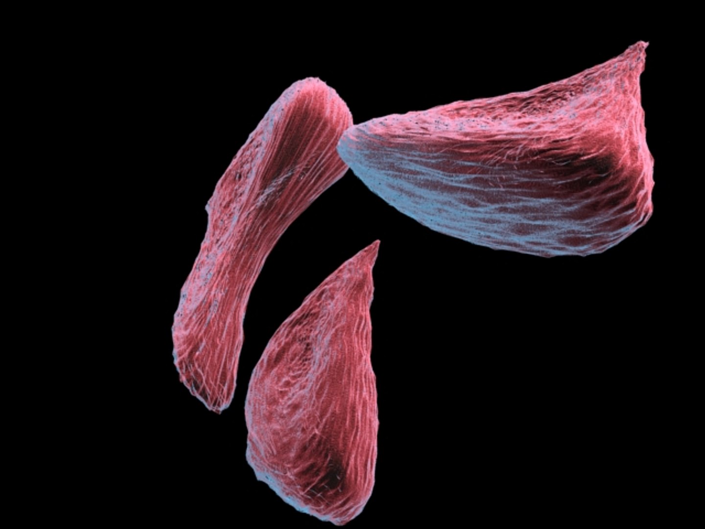 Blood Cells Sickle Anaemia 3d 3ds