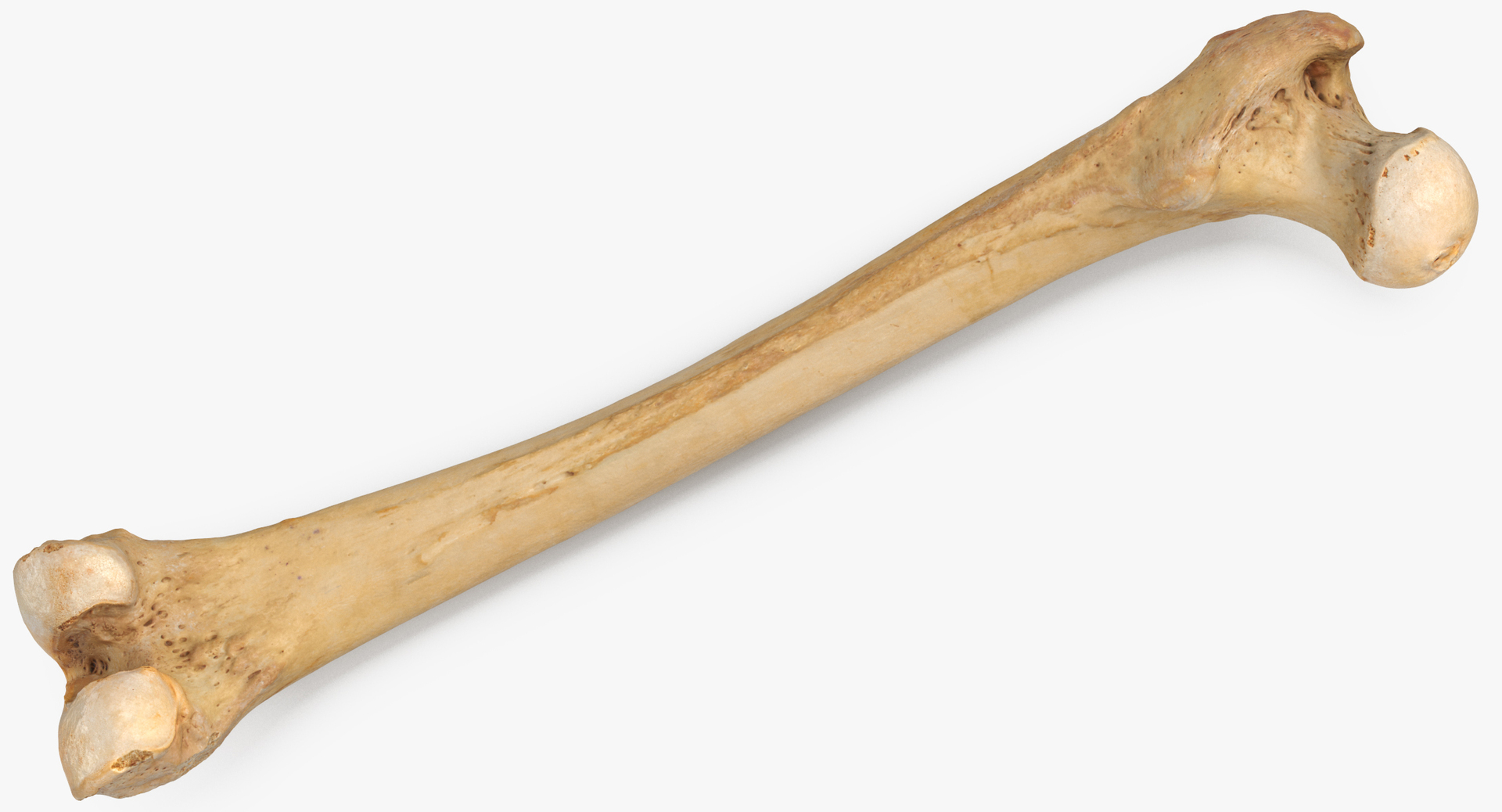 3D human femur bone 01 - TurboSquid 1422265