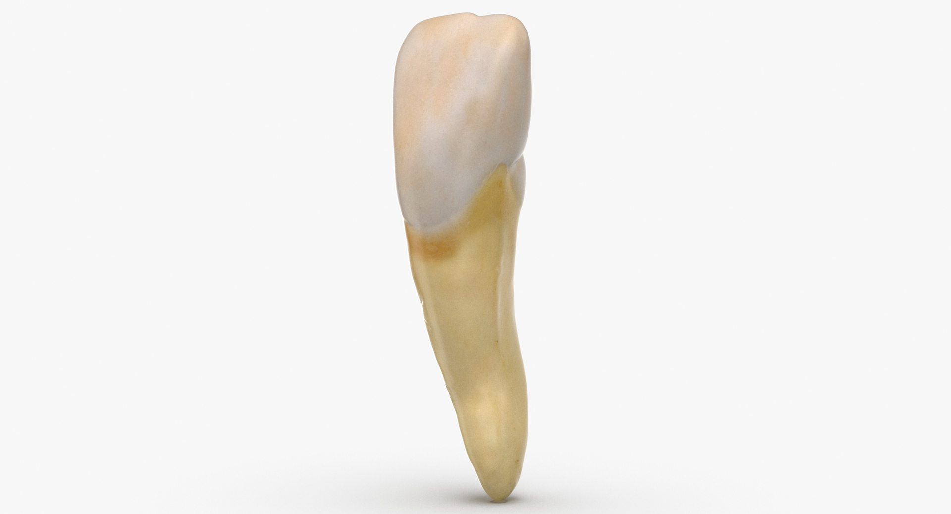 Human Incisors Clean and Broken Collection - 12 3D model - TurboSquid ...