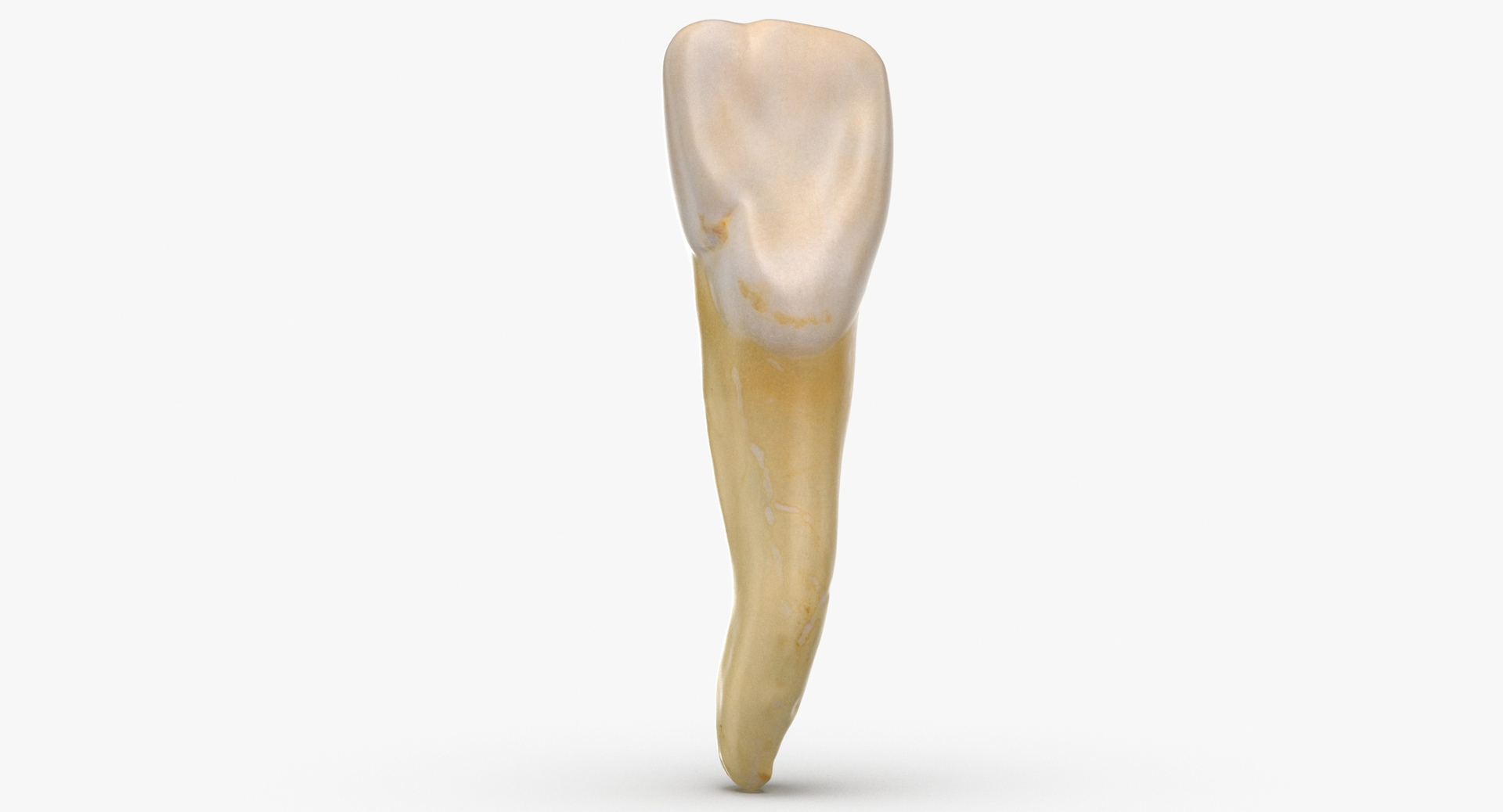 Human Incisors Clean and Broken Collection - 12 3D model - TurboSquid ...