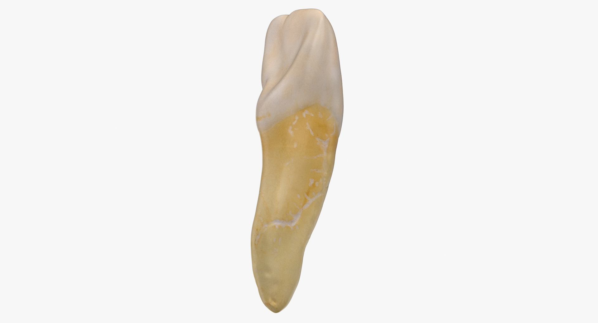 Human Incisors Clean and Broken Collection - 12 3D model - TurboSquid ...