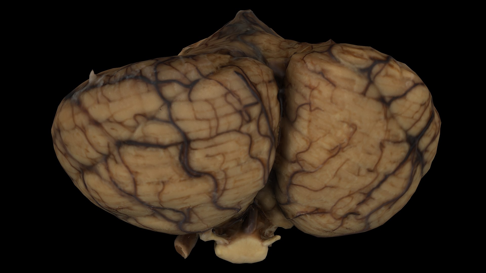 Human Brain Collection 3D - TurboSquid 2144968