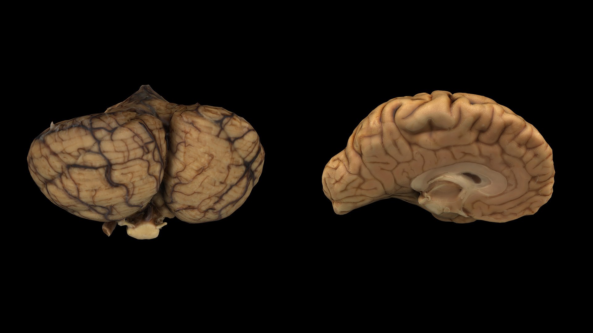 Human Brain Collection 3D - TurboSquid 2144968