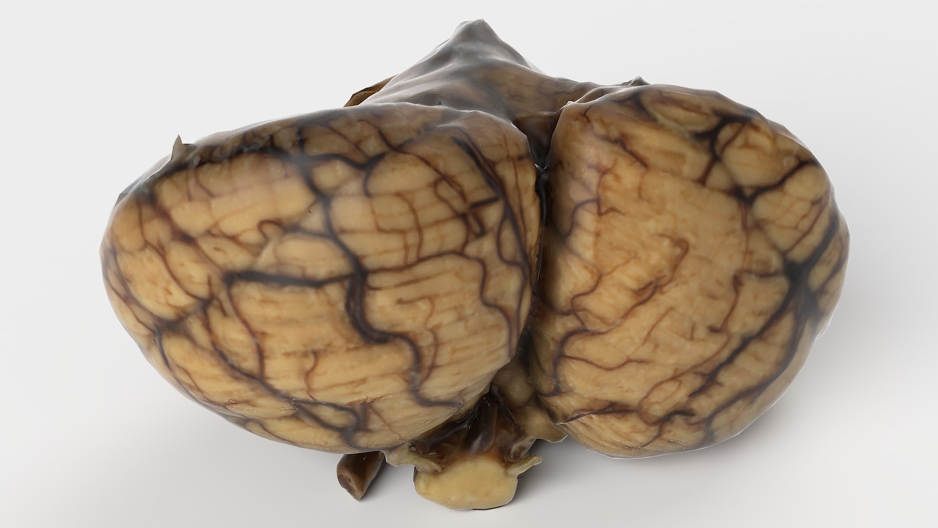 Human Brain Collection 3D - TurboSquid 2144968