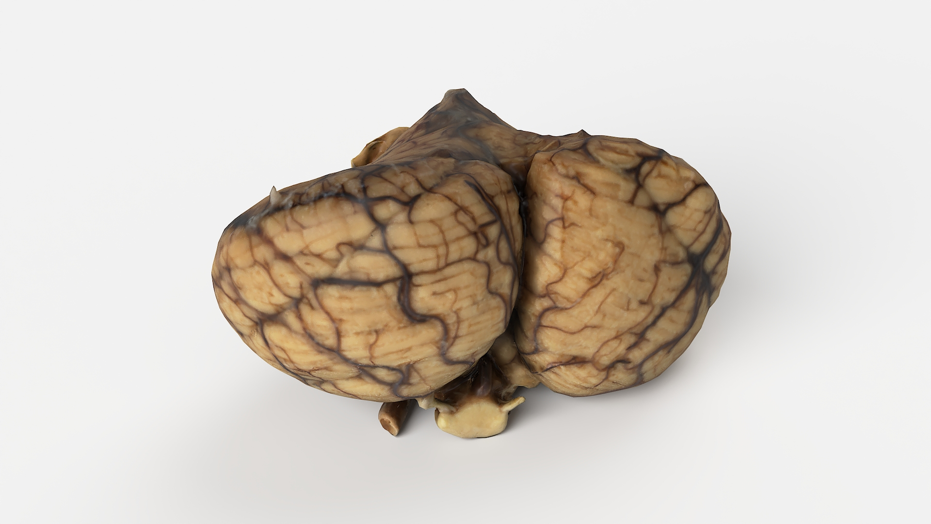 Human Brain Collection 3D - TurboSquid 2144968