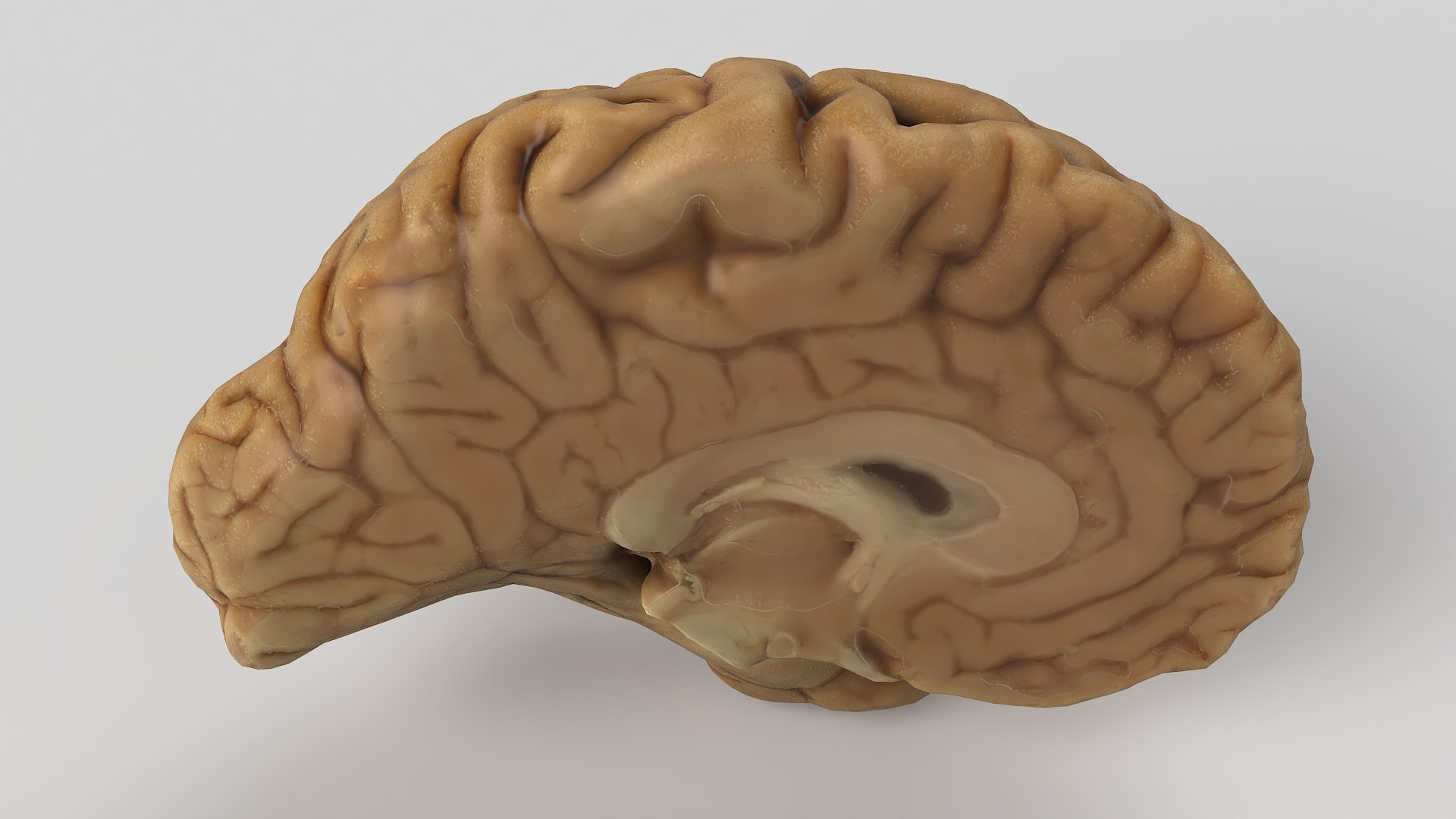 Human Brain Collection 3D - TurboSquid 2144968