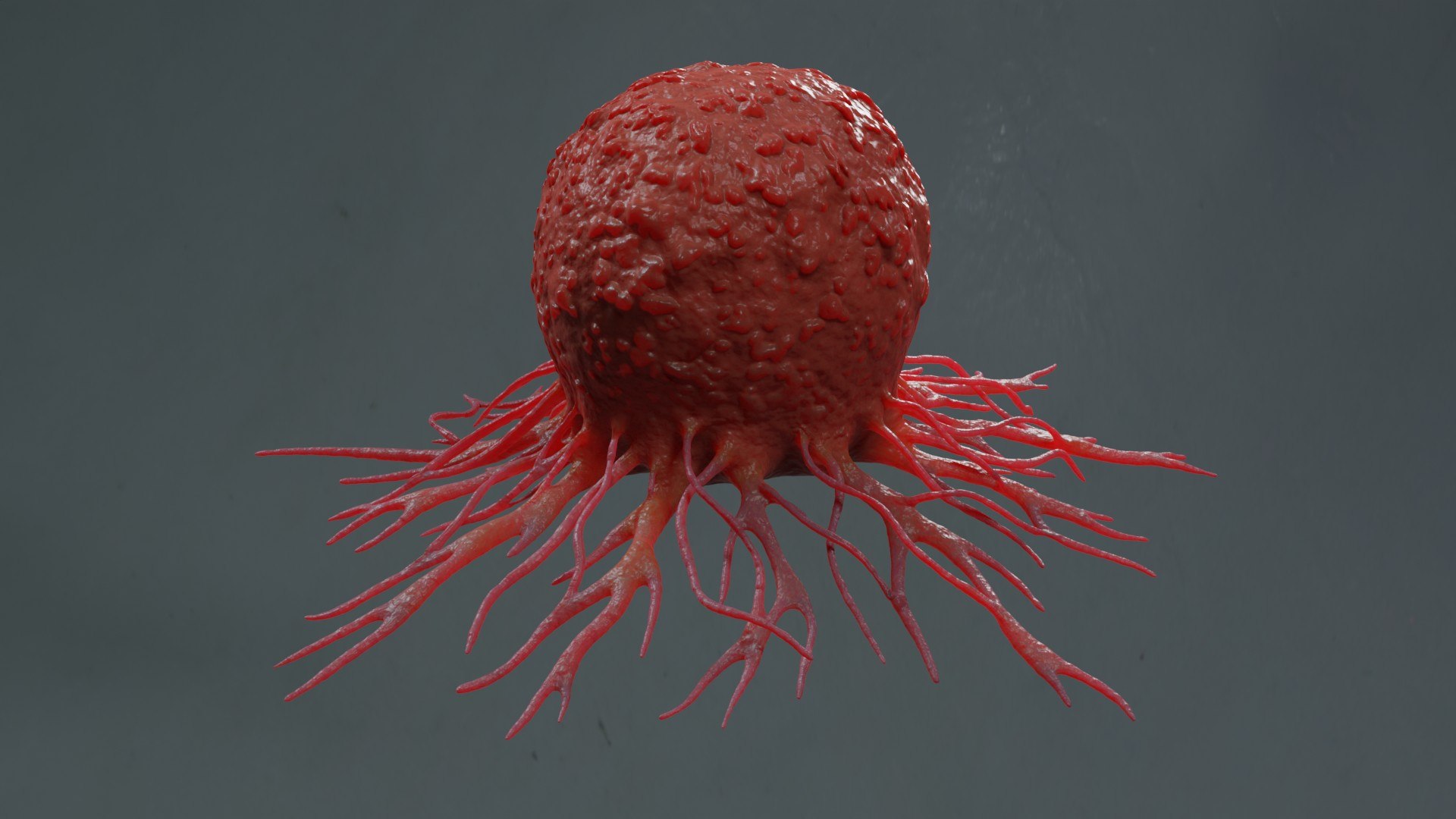 3D Tumor - TurboSquid 2103283
