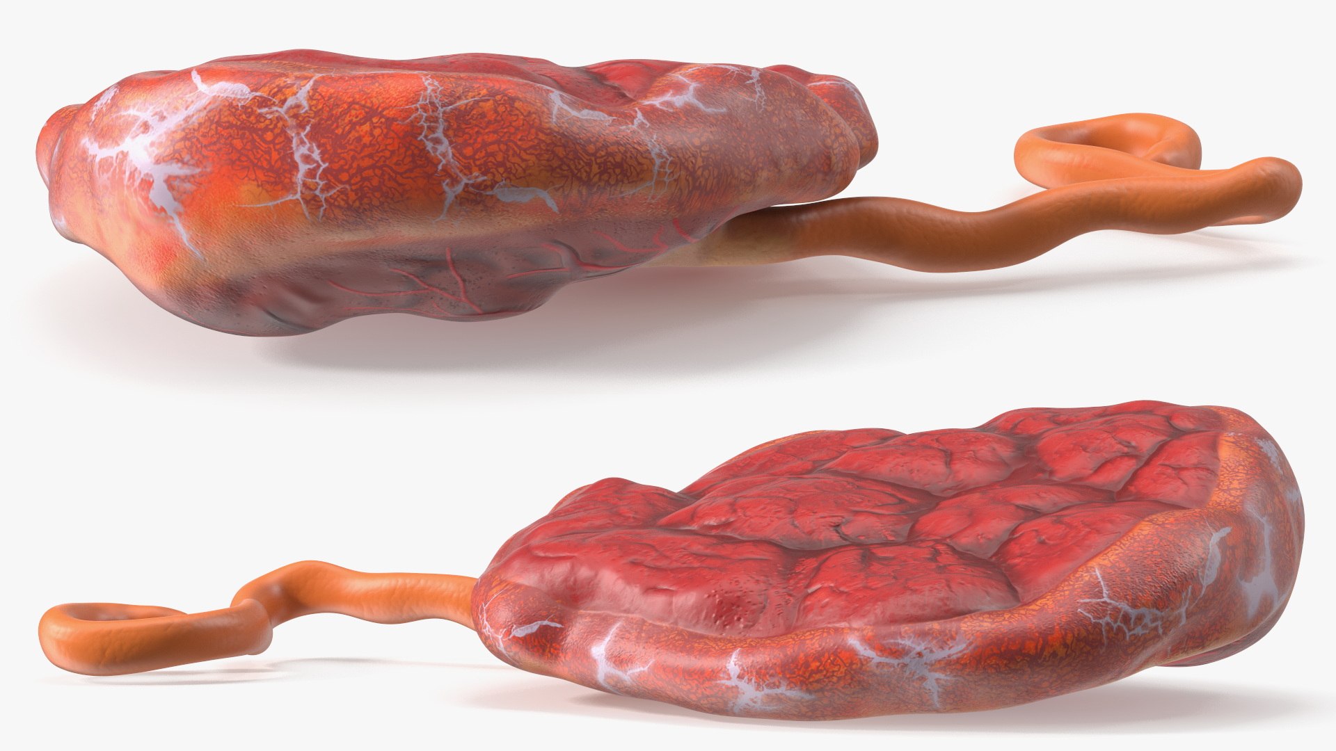 Human Placenta Anatomy Model With Umbilical Cord Model - TurboSquid 2409951