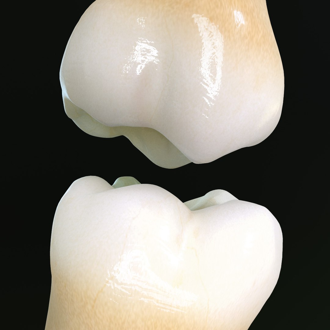 Teeth Molars 3d Max