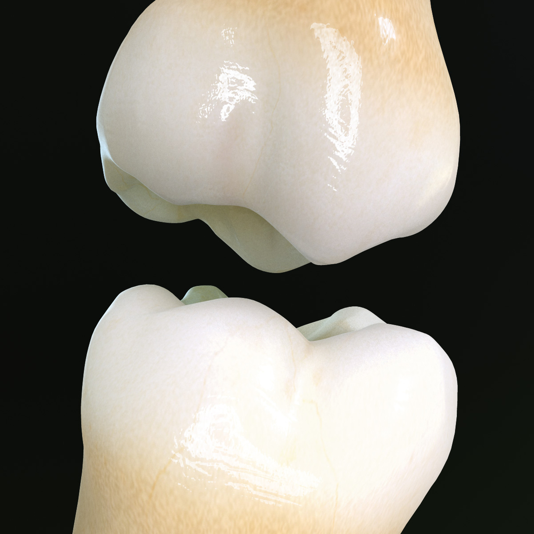 teeth molars 3d max