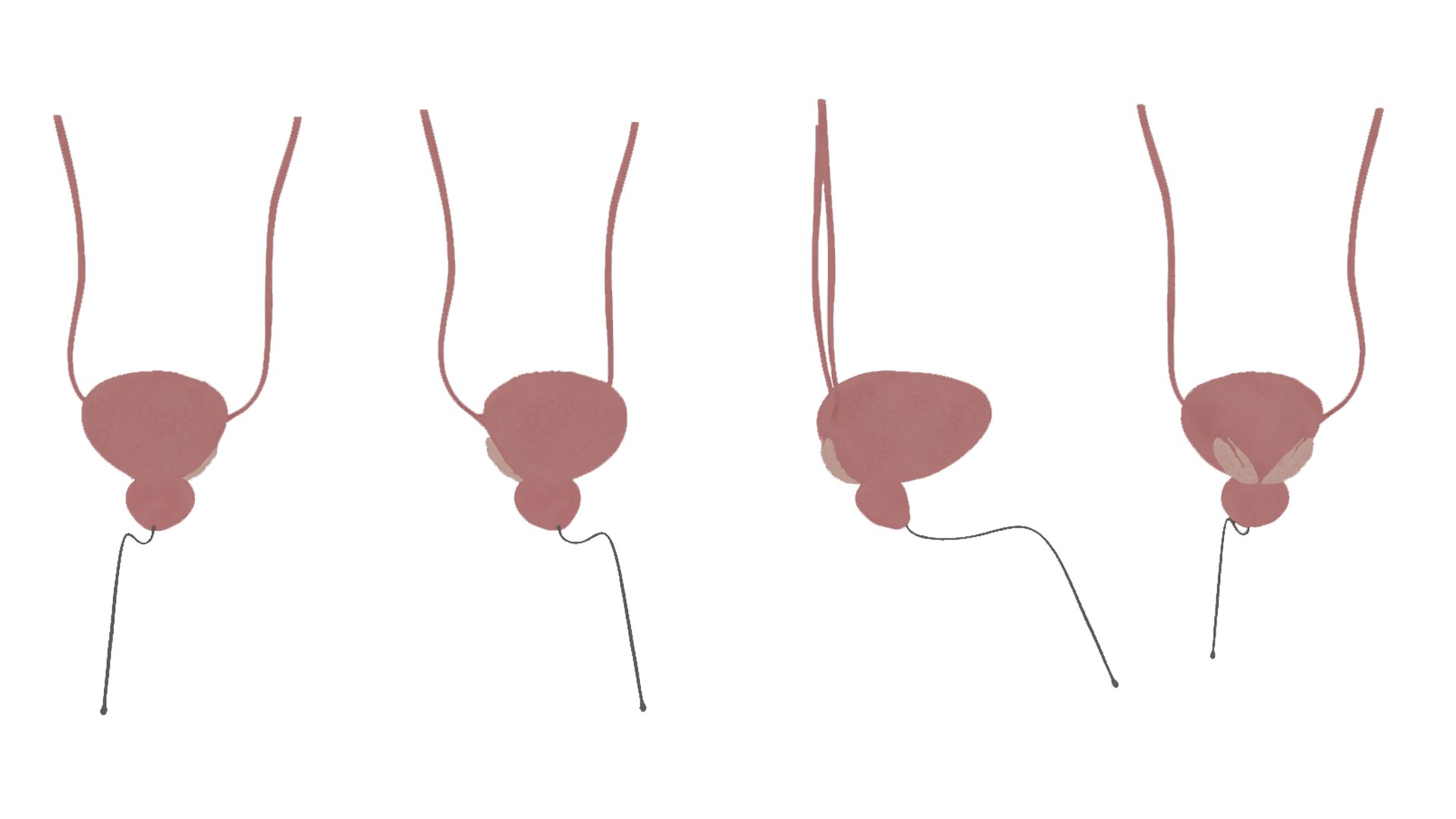 Bladder And Prostate Anatomy 3D Model - TurboSquid 2072102