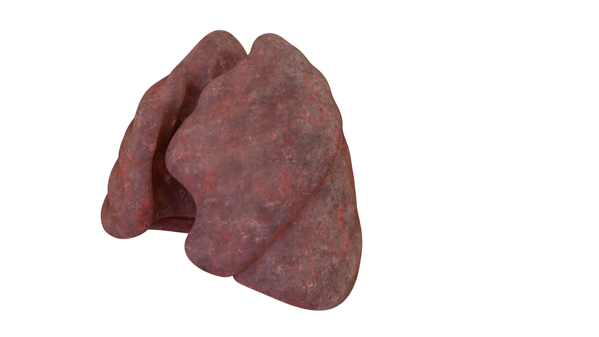 Smoker Human Lungs 3D Model - TurboSquid 2332174