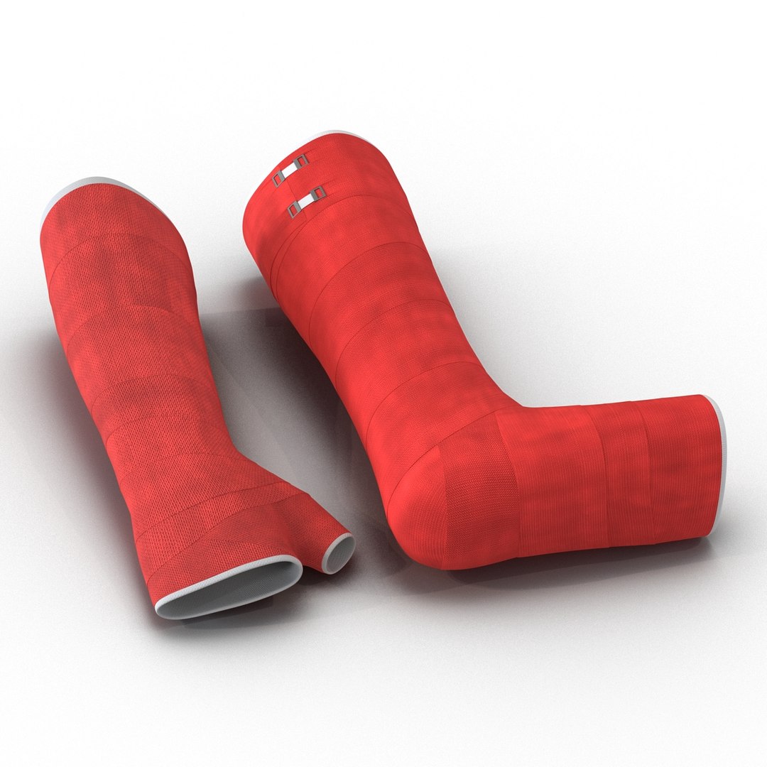 max orthopedic cast arm leg