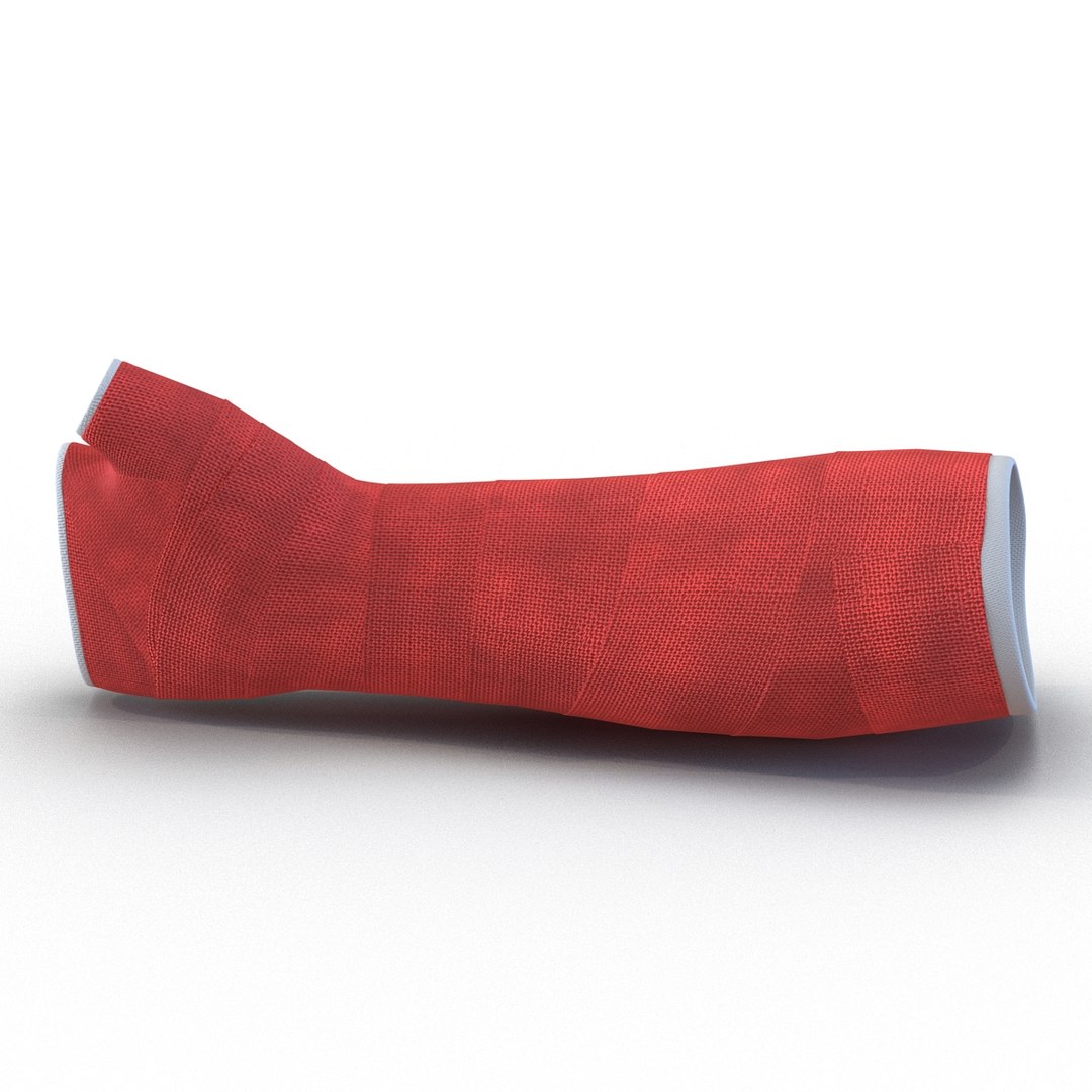 max orthopedic cast arm leg