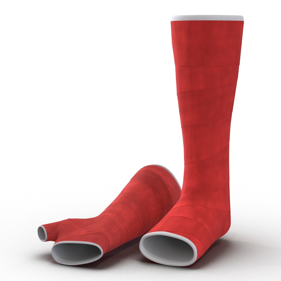 max orthopedic cast arm leg