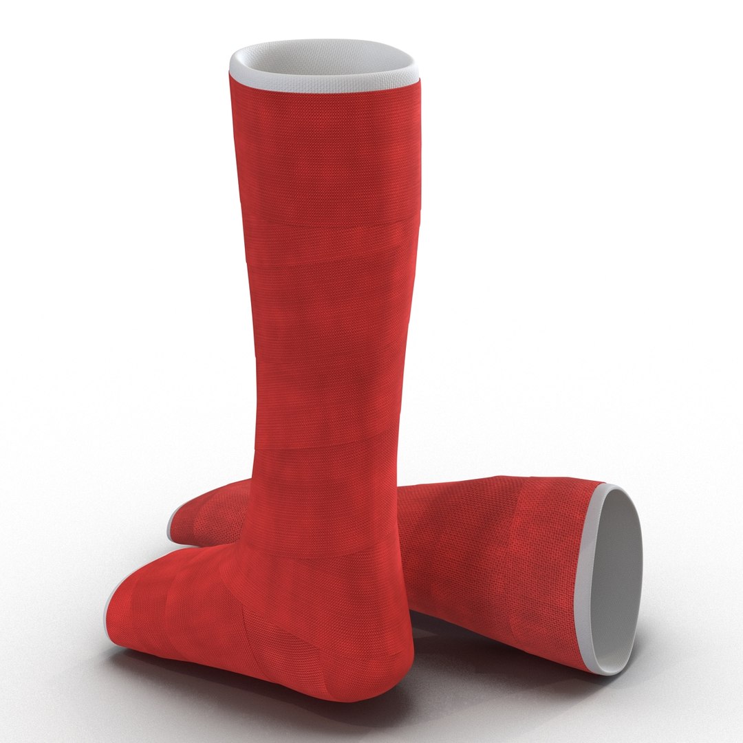 max orthopedic cast arm leg