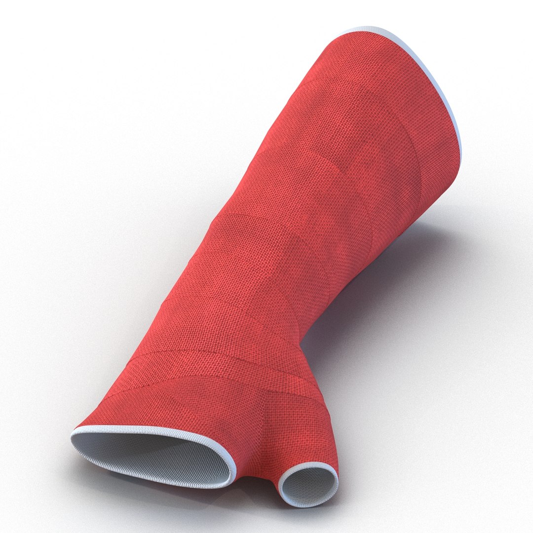 max orthopedic cast arm leg